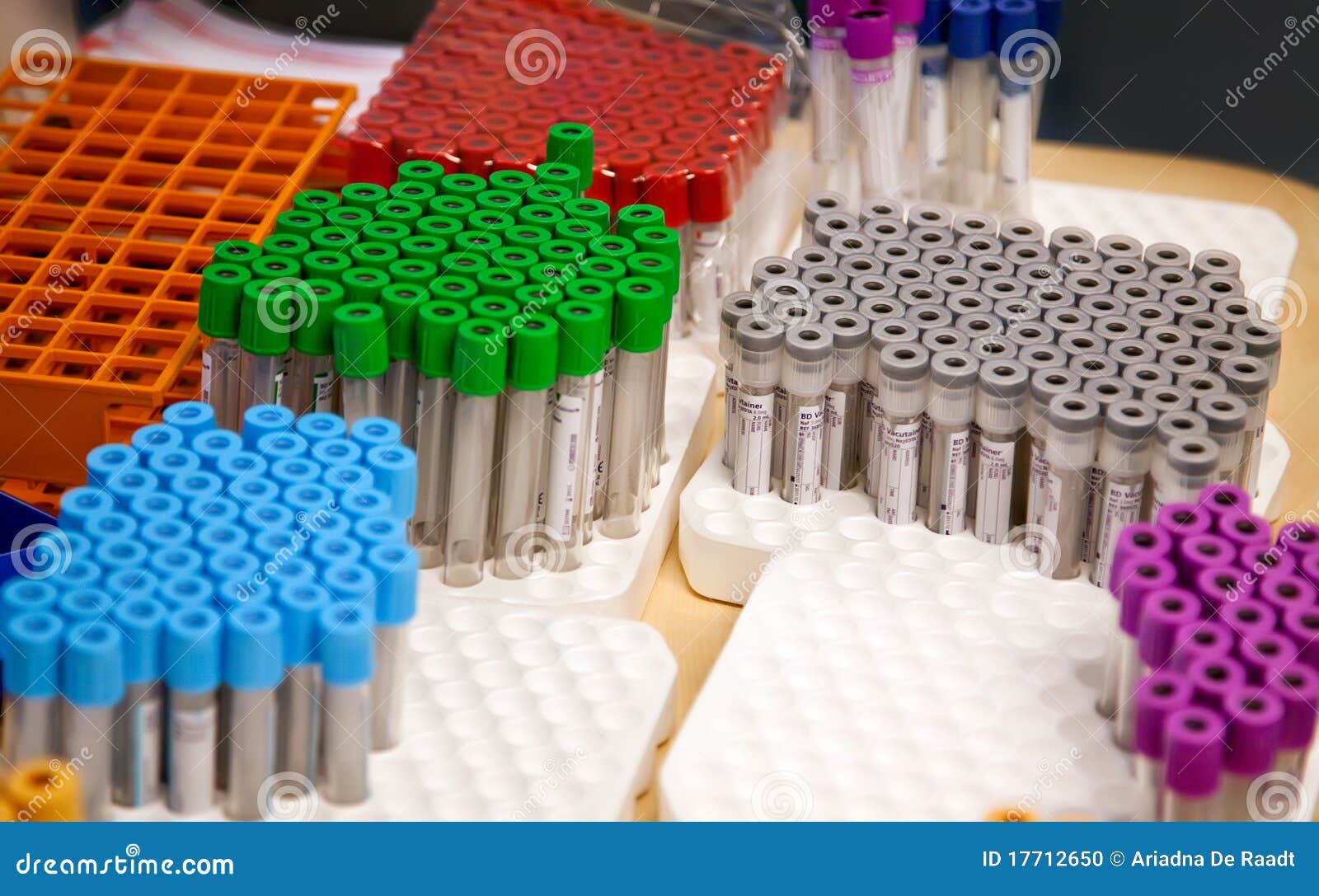 Laboratory for Blood Research Stock Photo - Image of blood, industry ...