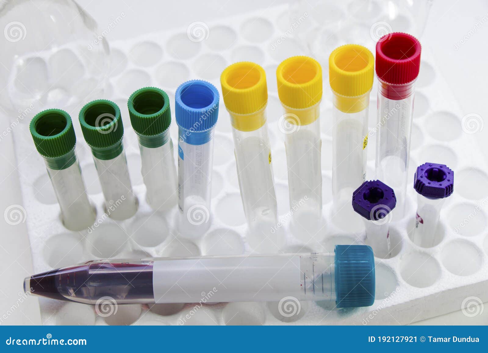 Laboratory Blood Test Tube Samples, Research Diagnoses, Instruments and ...