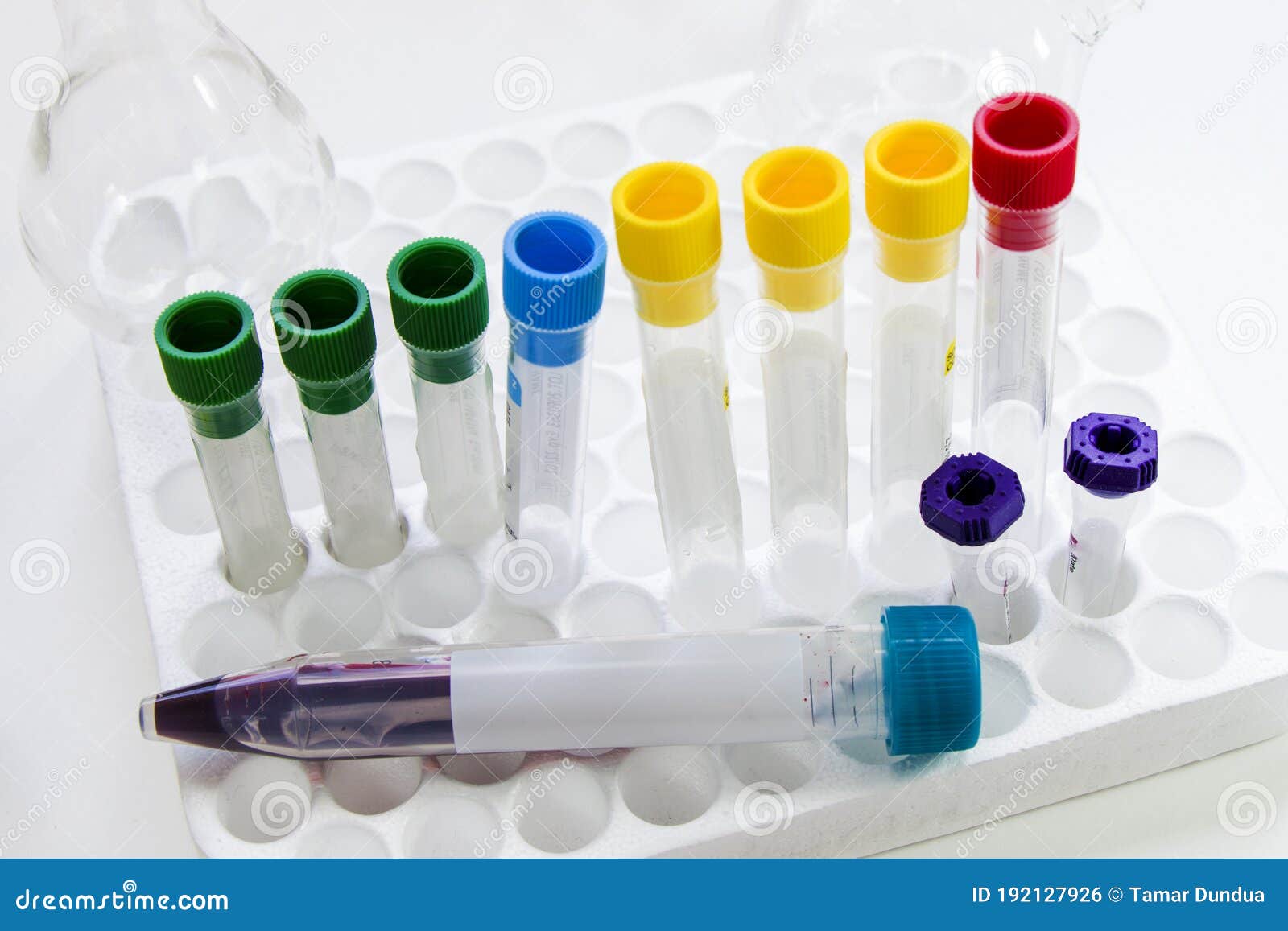 Laboratory Blood Test Tube Samples, Research Diagnoses, Instruments and ...
