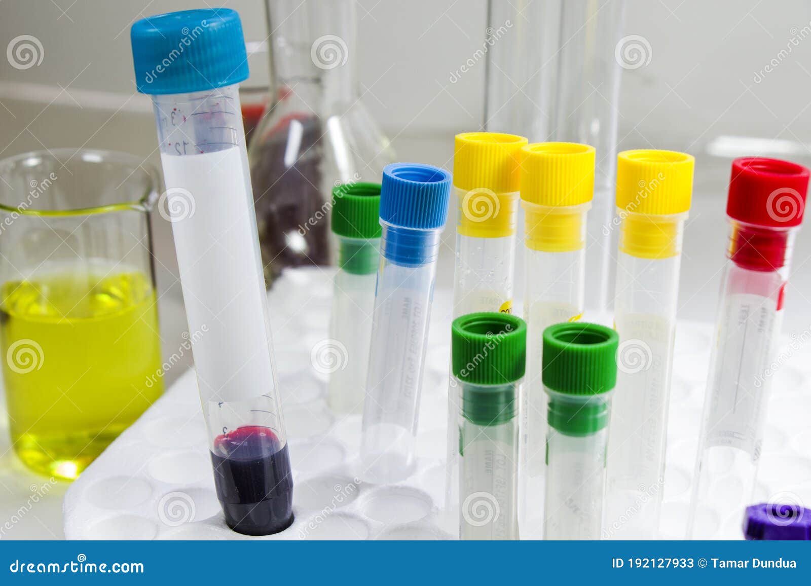 Laboratory Blood Test Tube Samples, Research Diagnoses, Instruments and ...