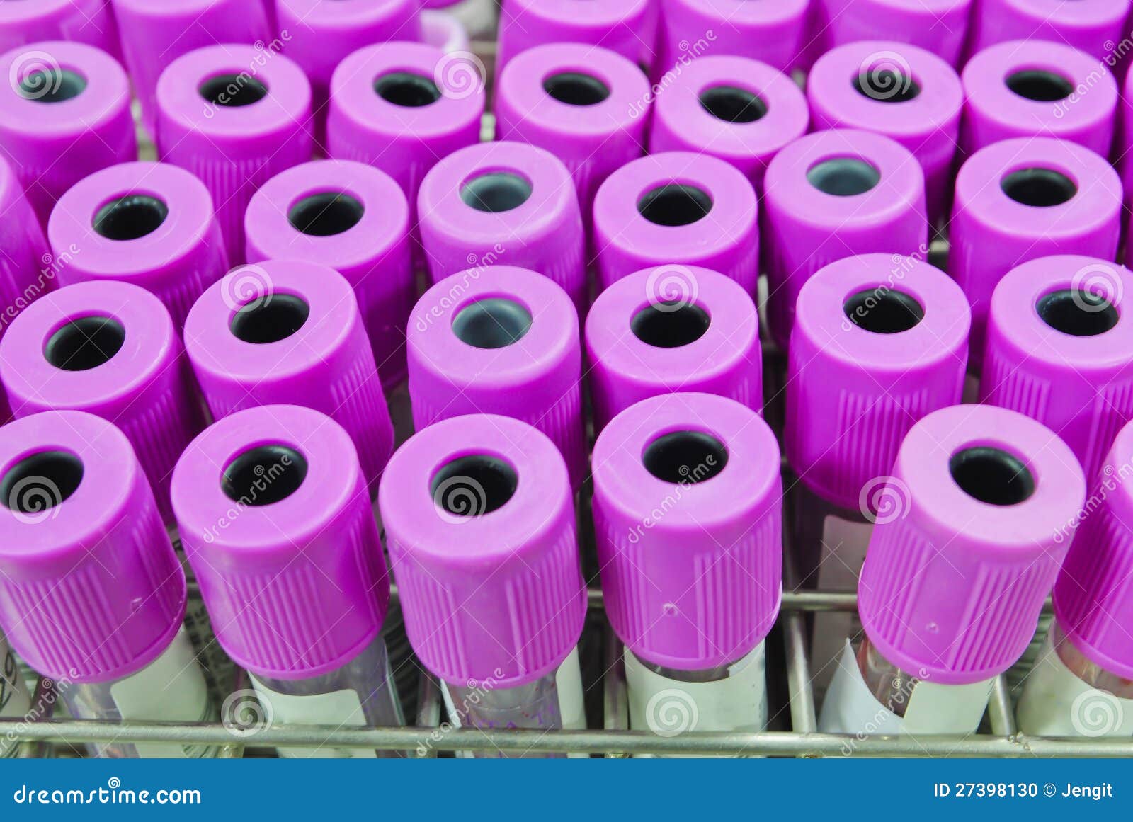 Laboratory Blood Tube stock photo. Image of analysis - 27398130