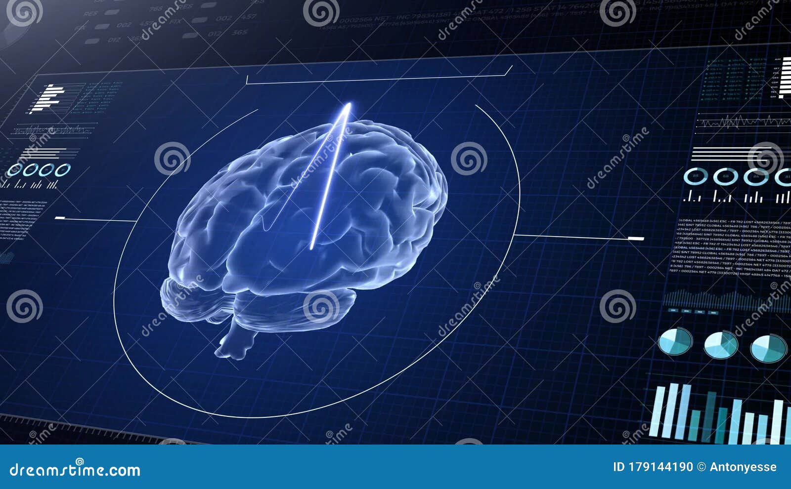 Human Brian Study on Diagnostic Computer Display Stock Footage - Video ...