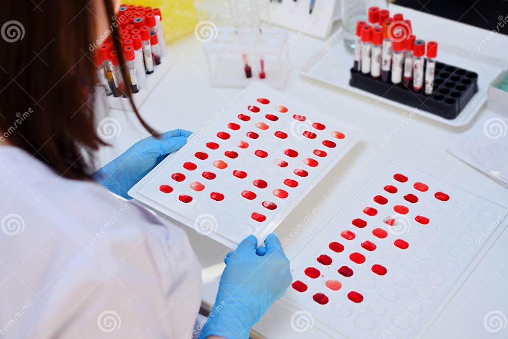 Laboratory Determination of Blood Type. Blood Test Stock Photo - Image ...
