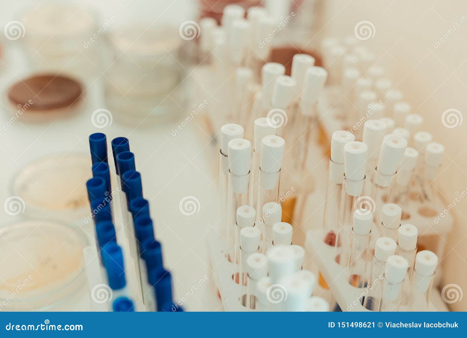 Top View of Test Tubes Standing in the Rack Stock Image - Image of ...