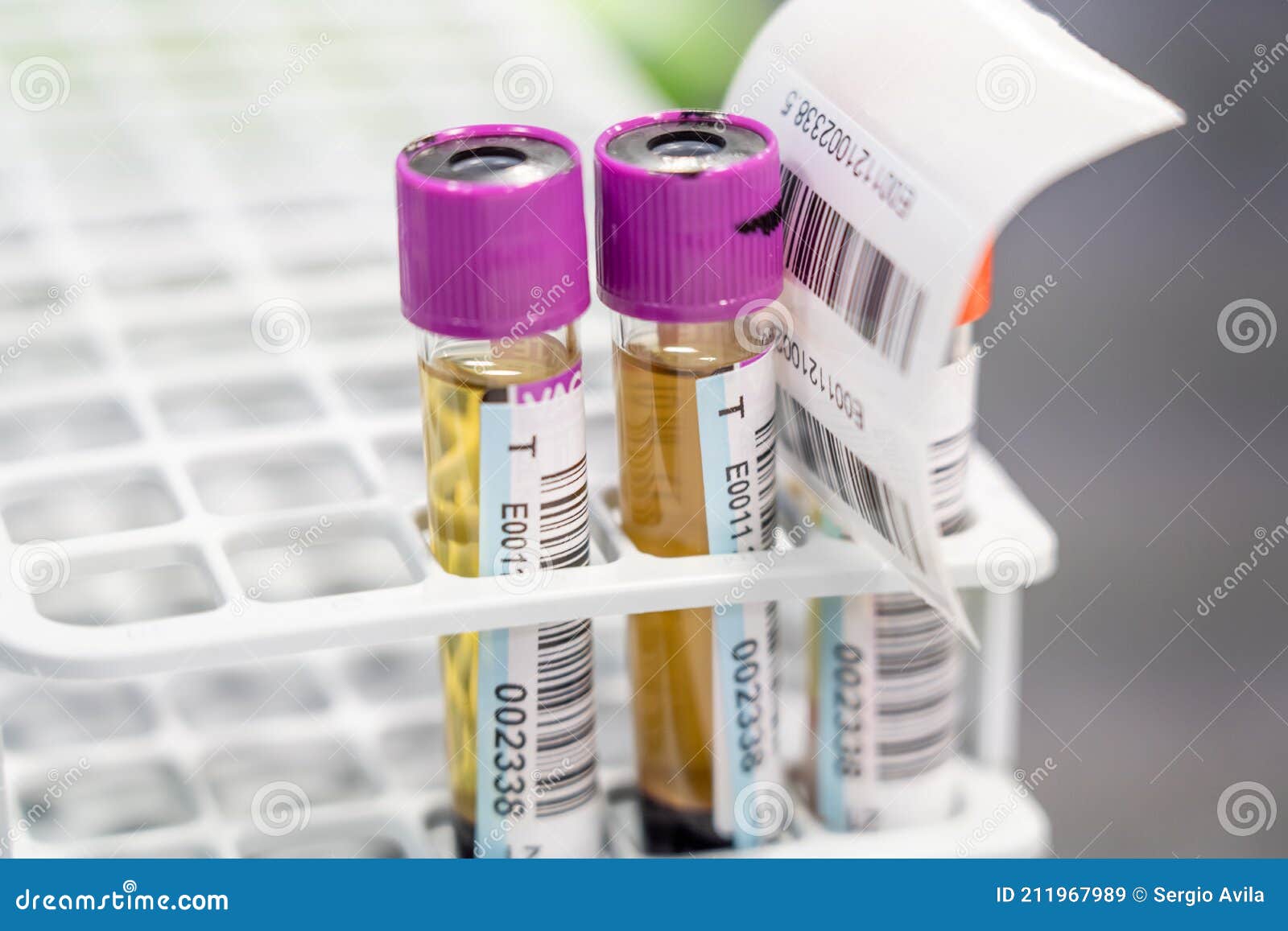 Laboratory Doing Tests for Vaccine Blood Extraction and Analytical ...
