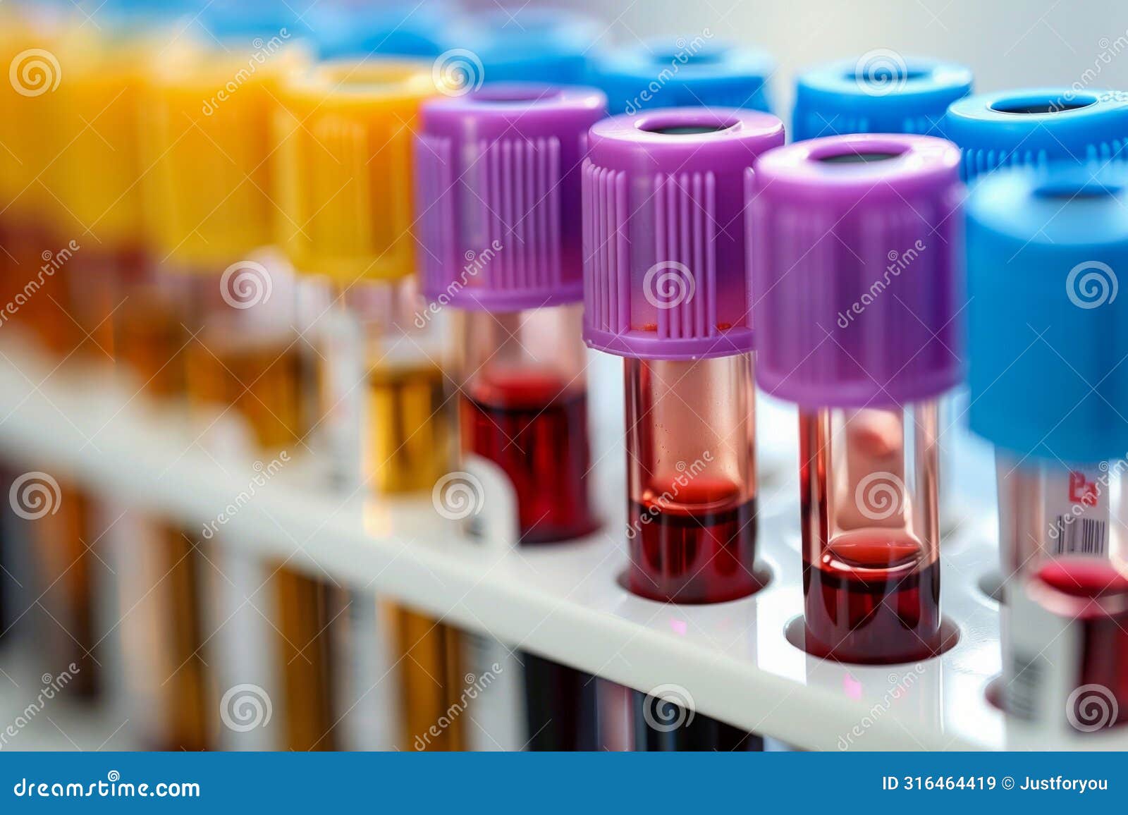 Laboratory Precision in Blood Testing. Generative Ai Stock Illustration ...