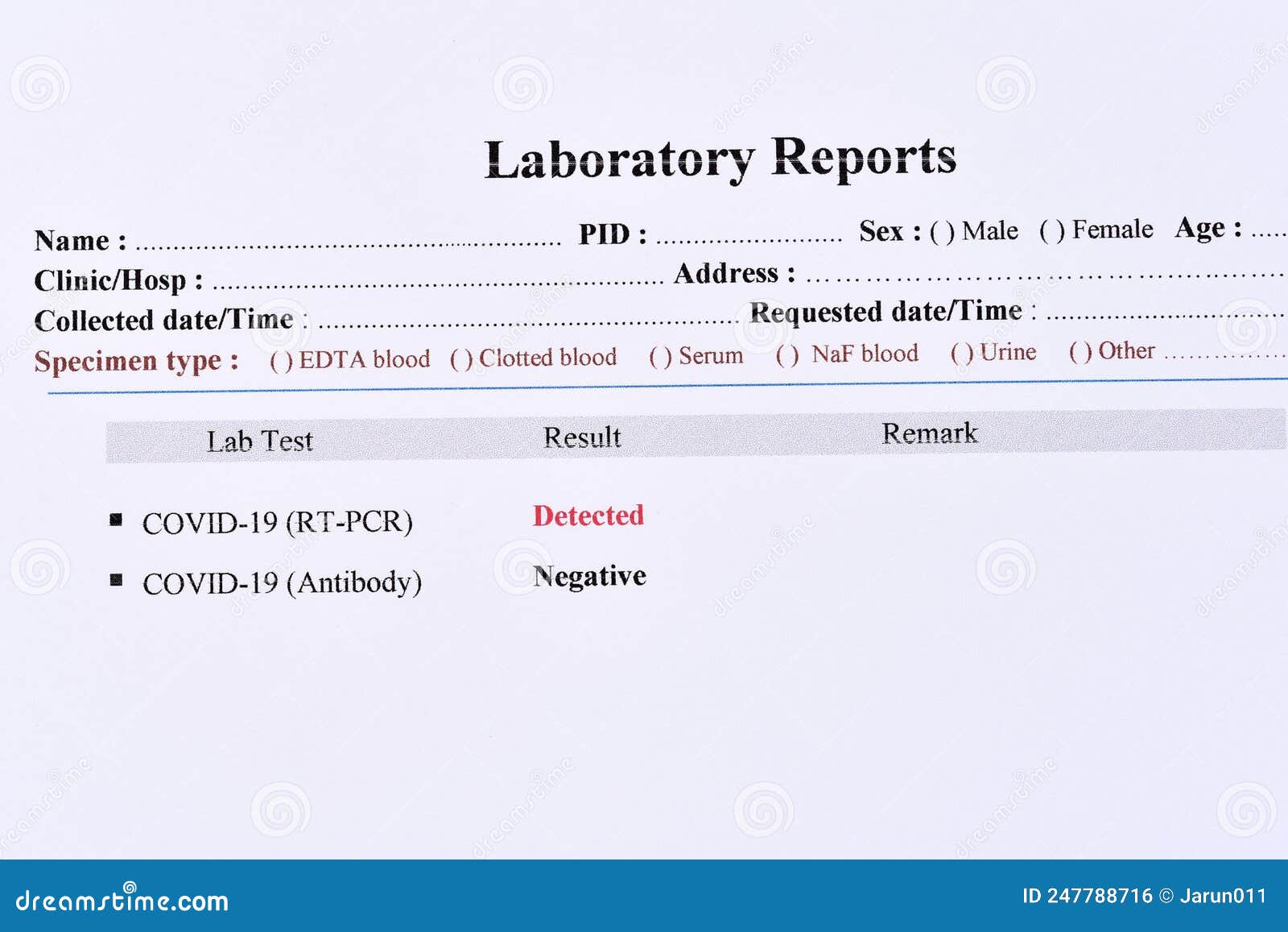Laboratory Report of COVID-19 Testing Stock Photo - Image of diagnosis ...