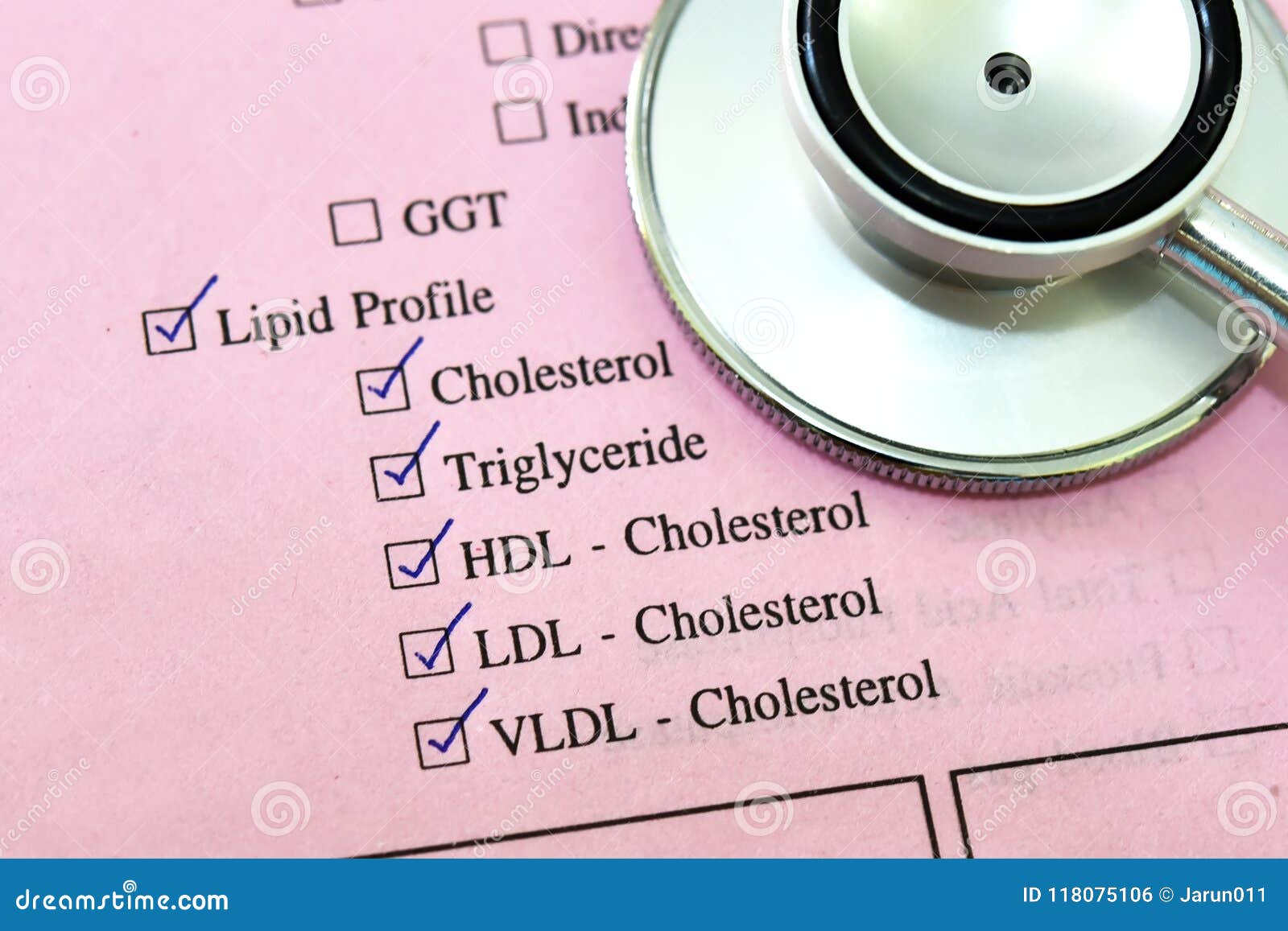 Lipid profile test stock photo. Image of hypercholesterolemia - 118075106