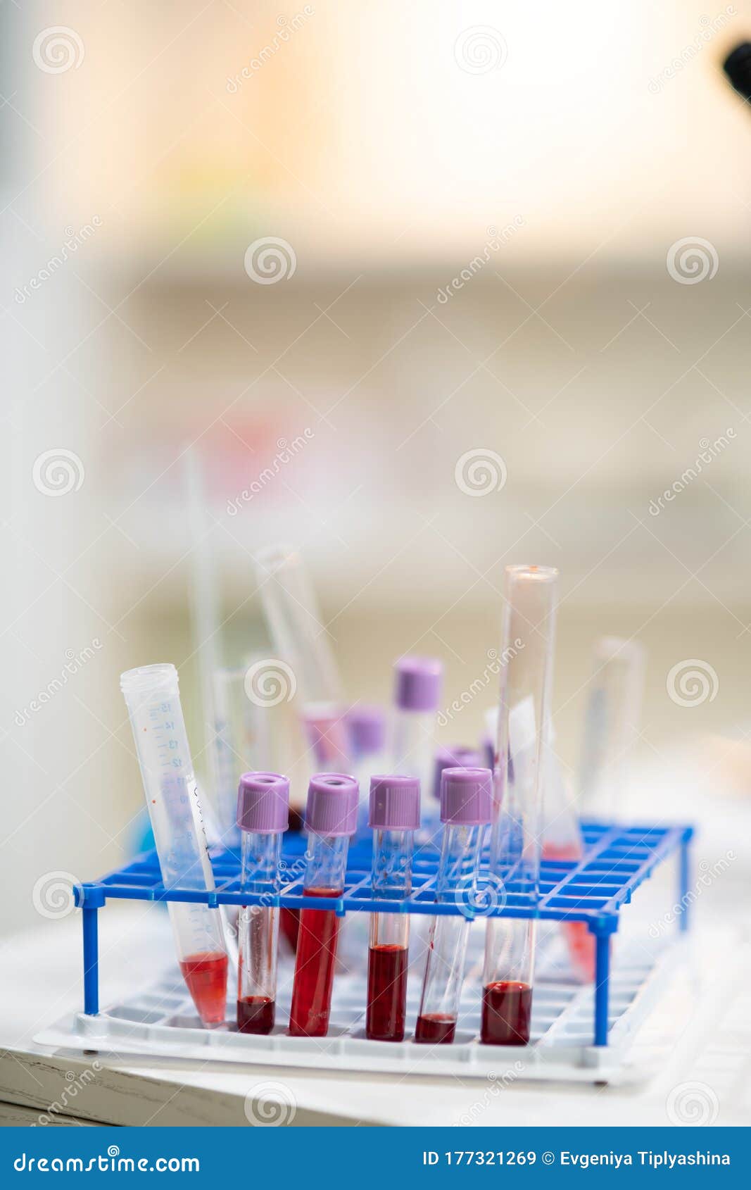 Microscope with Test Tubes on a Laboratory Bench Stock Image - Image of ...