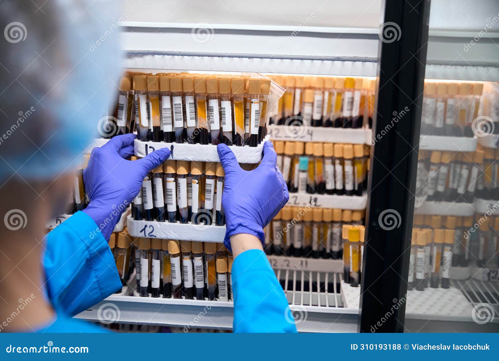 Laboratory Technician Holds Set with Biomaterial for Blood Analysis in ...