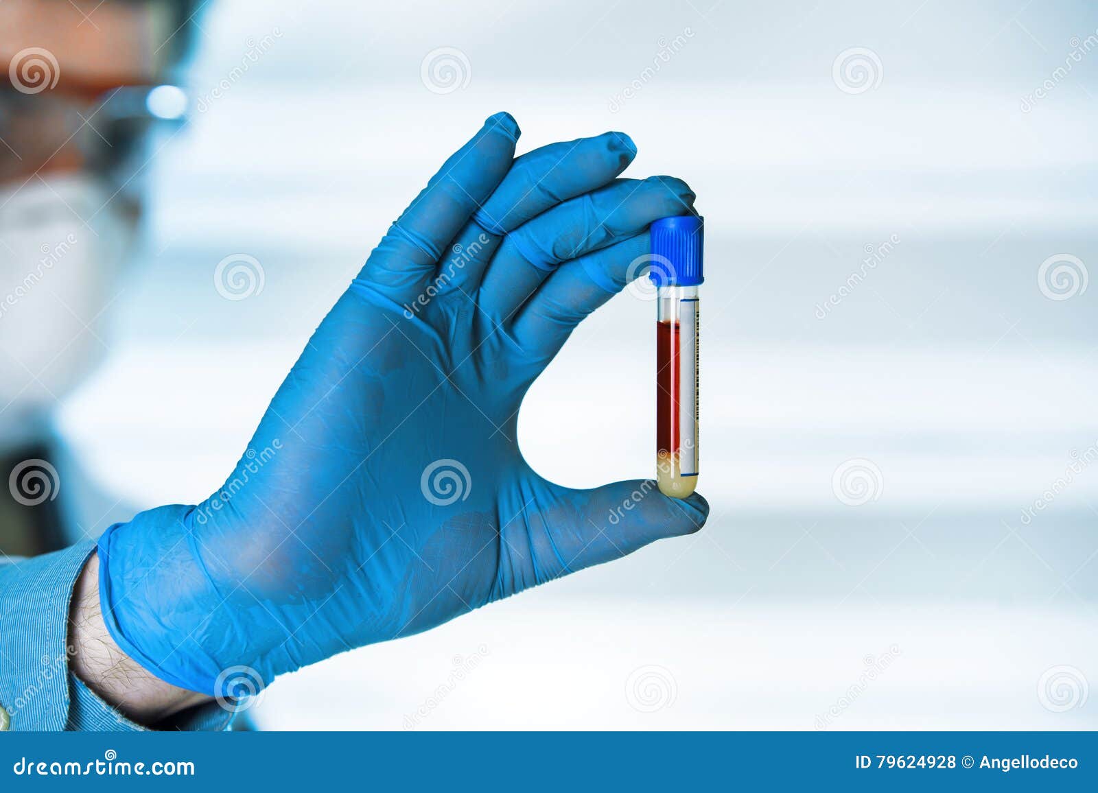 Laboratory Technician in Lab Examining Blood Sample Stock Photo - Image ... Laboratory Technician in Lab Examining Blood Sample Stock Photo - Image ...