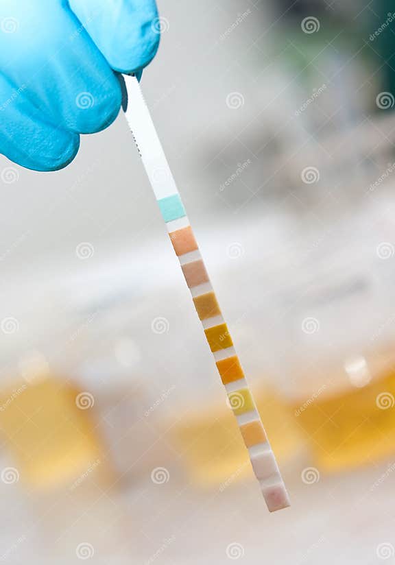 Laboratory test stripe stock image. Image of special - 14016167