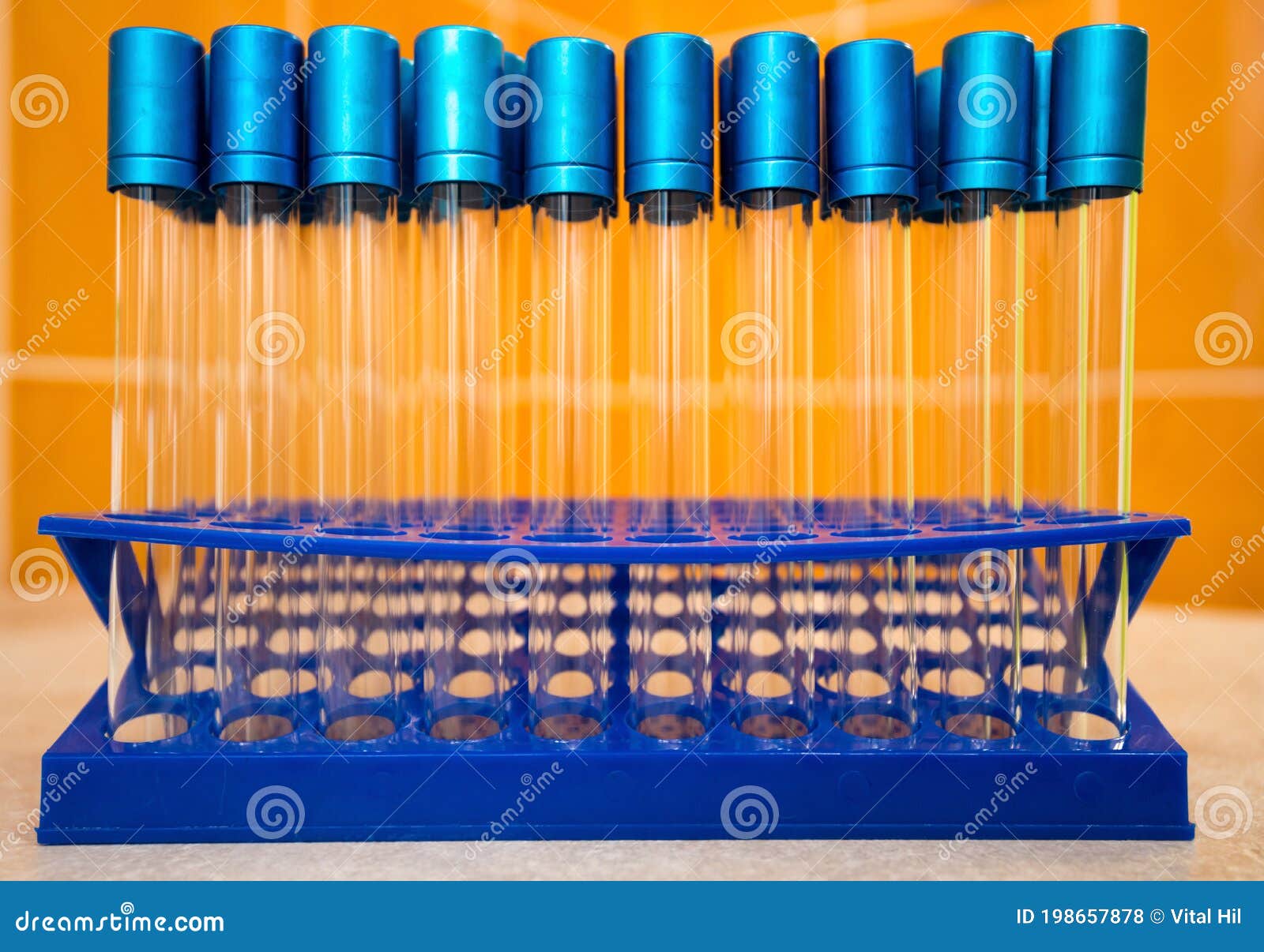 Laboratory Test Tubes in the Laboratory on the Table Stock Photo ...