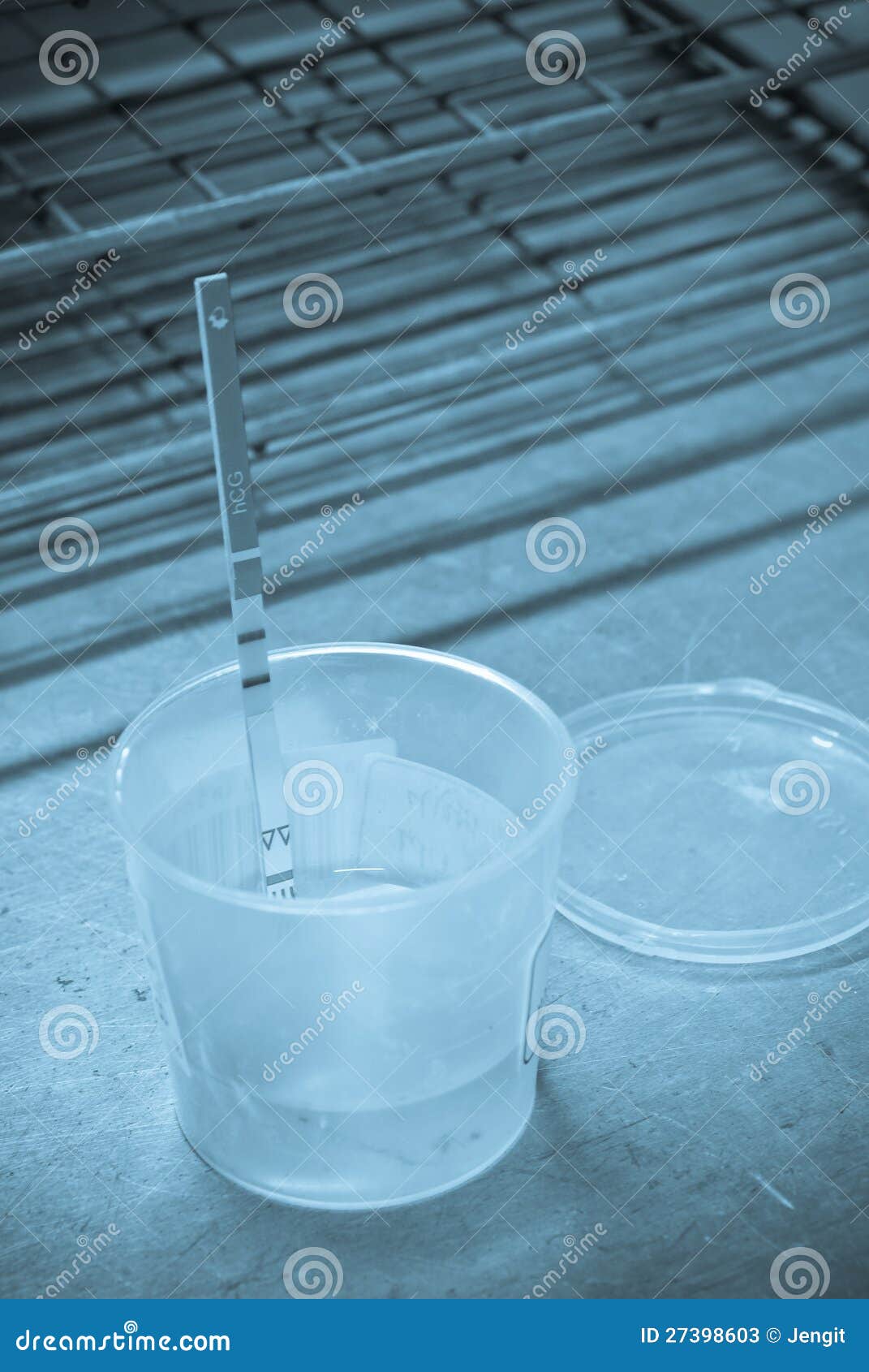 Laboratory Urine Test On White Background. Mycoplasma And Ureaplasma ...