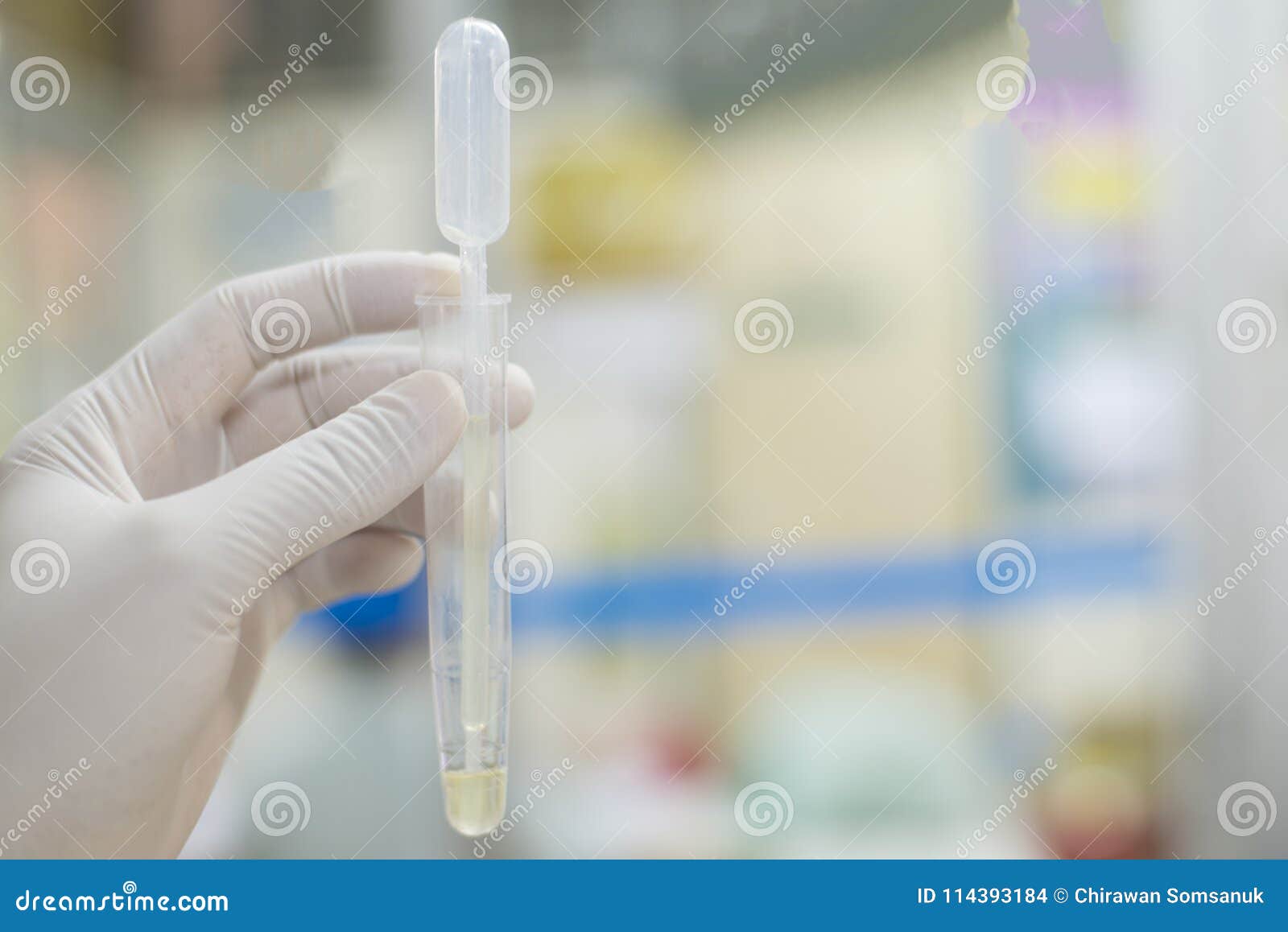 Laboratory Urine Test On White Background. Mycoplasma And Ureaplasma ...