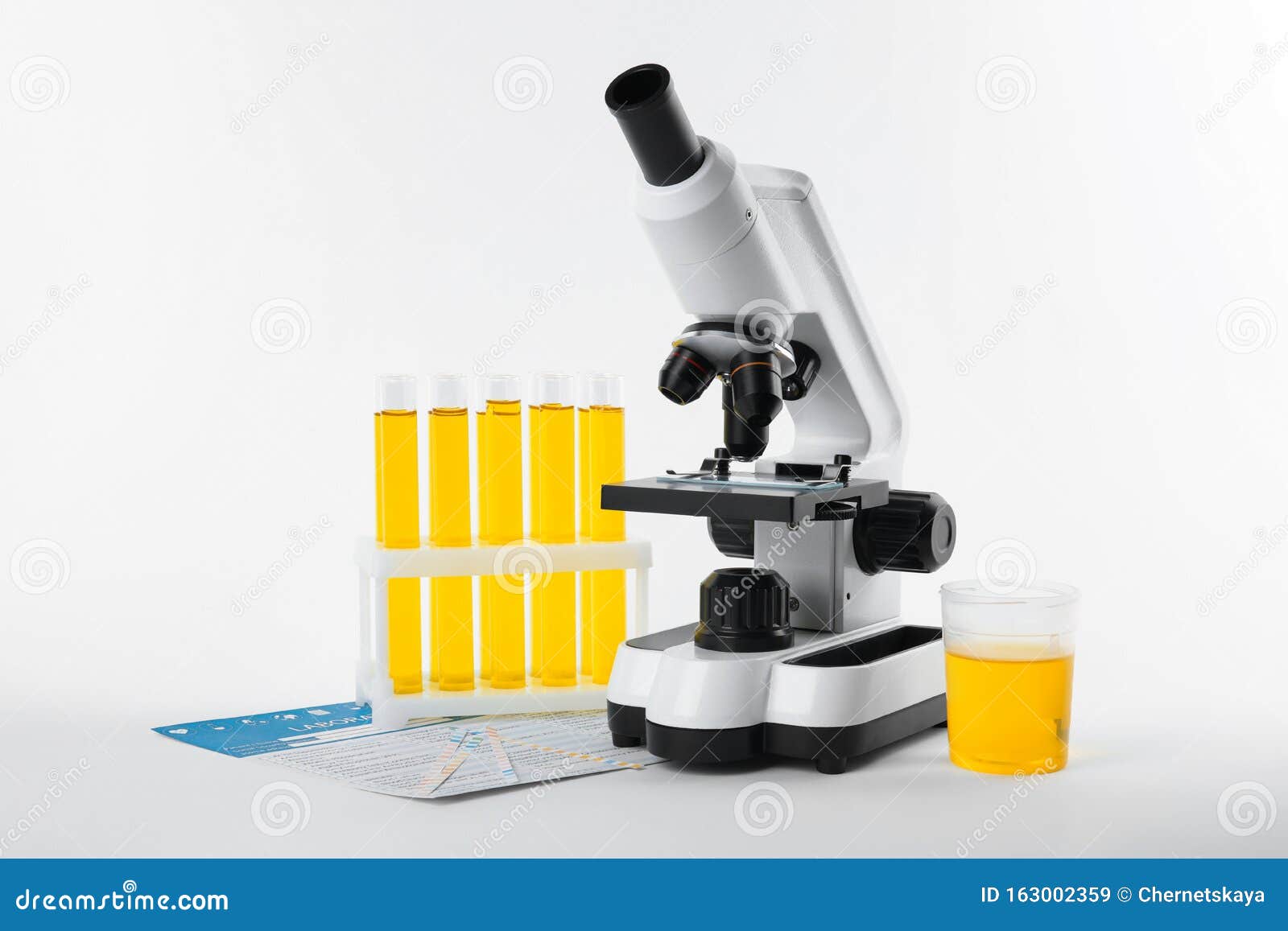 Laboratory Ware with Urine Sample for Analysis and Microscope on ...