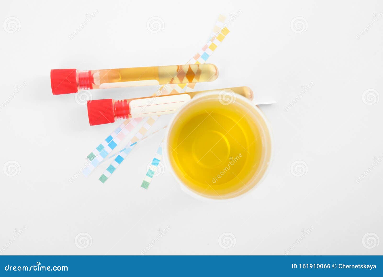 Laboratory Ware With Urine Sample For Analysis And Microscope On White ...