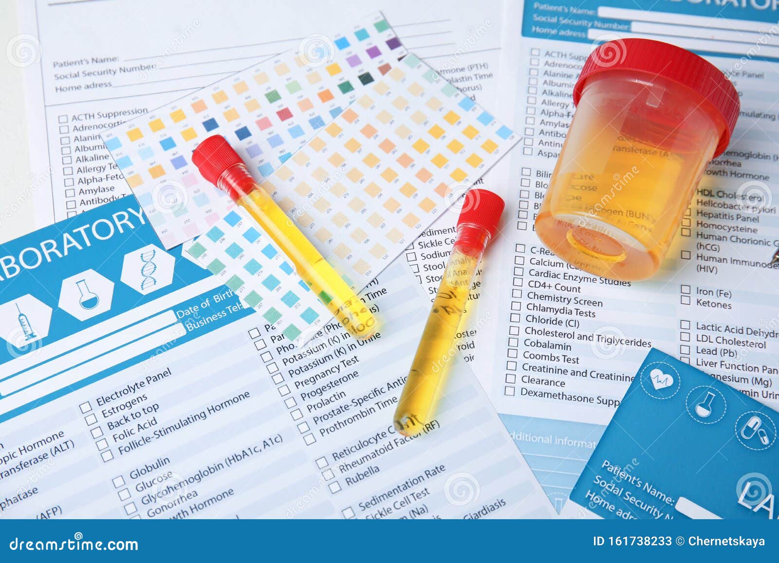 Laboratory Ware With Urine Samples For Analysis And Microscope On White ...
