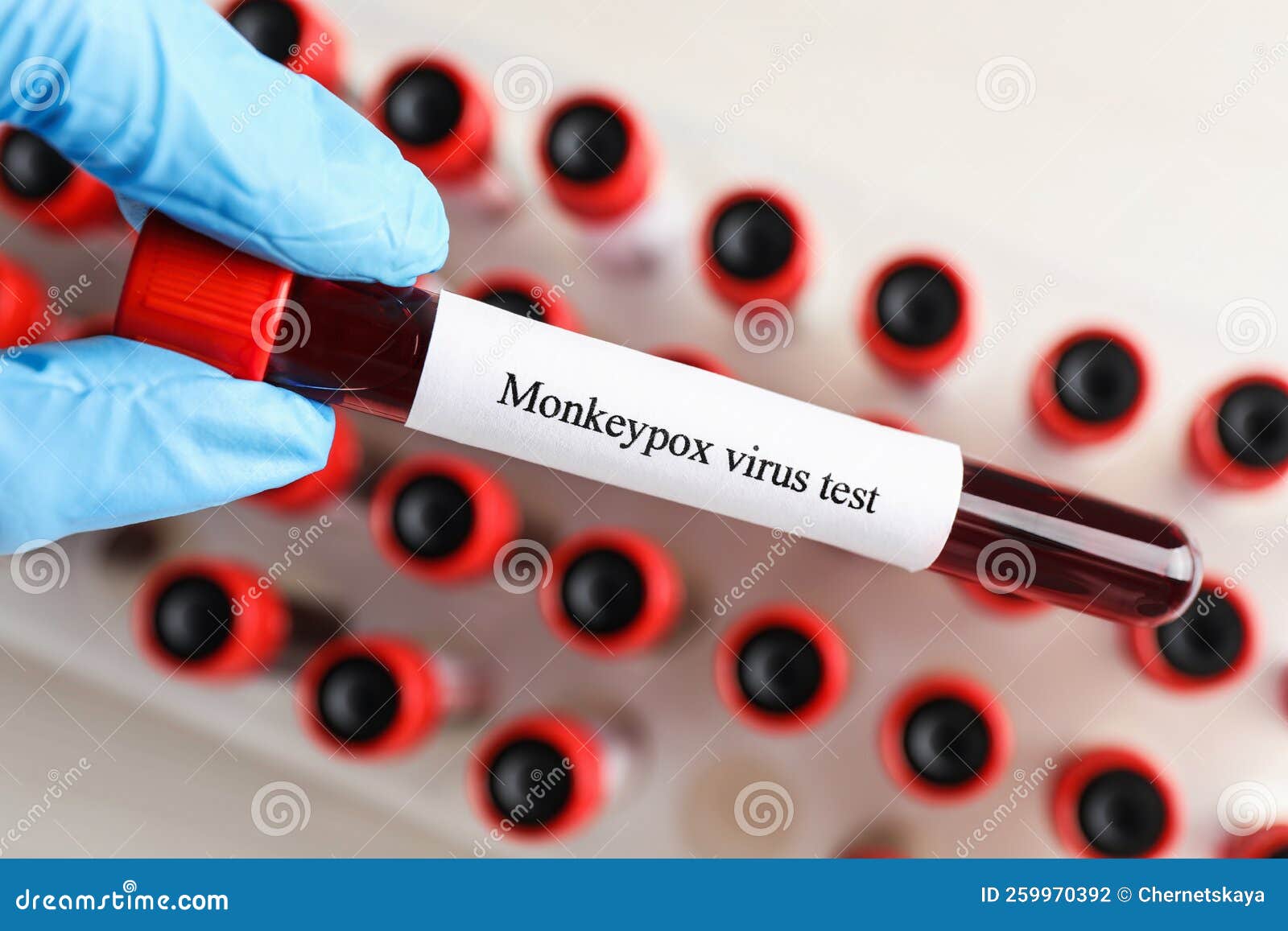 Laboratory Worker Holding Test Tube with Blood Sample Over Rack ... Laboratory Worker Holding Test Tube with Blood Sample Over Rack ...
