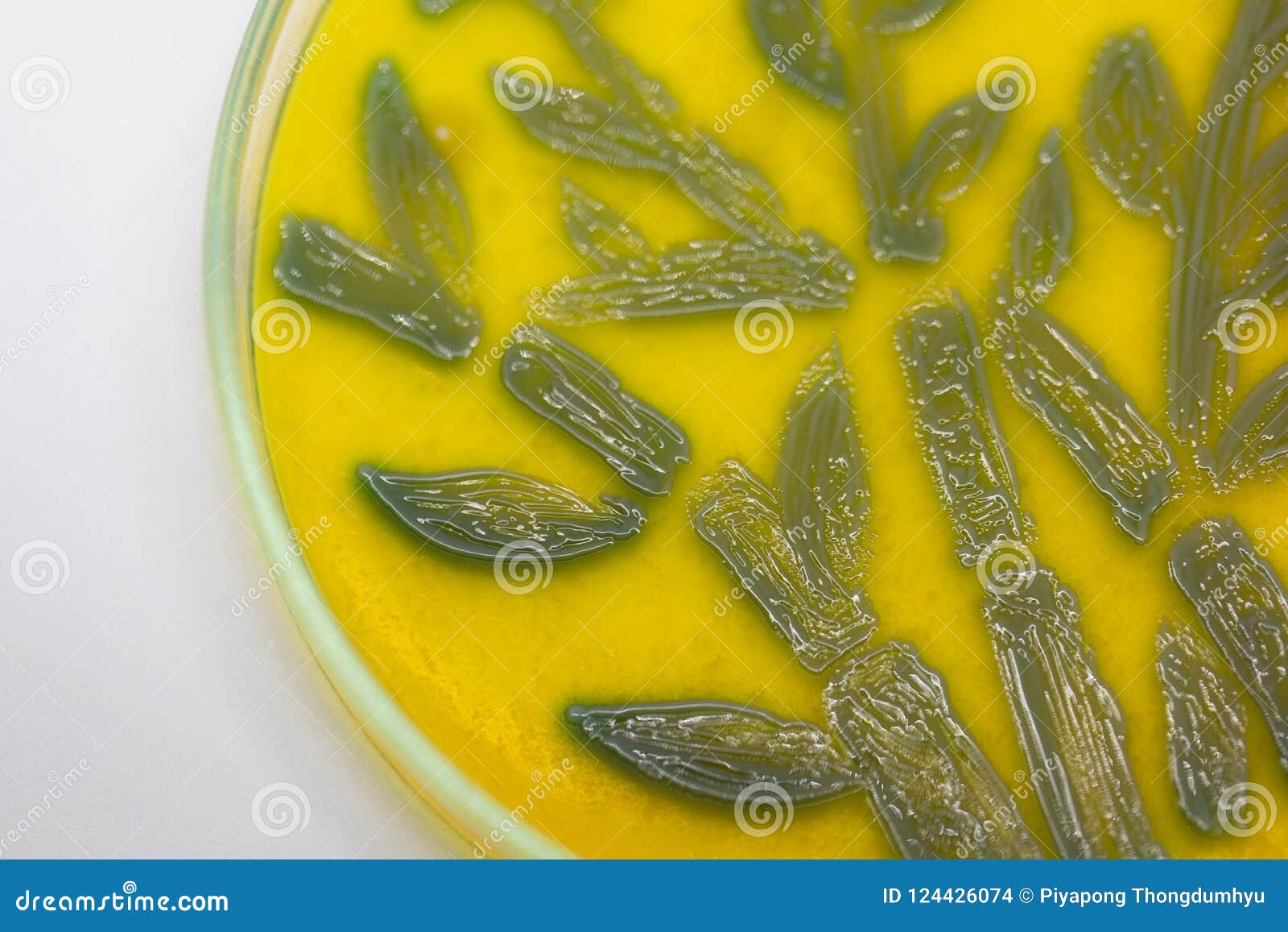 Lactobacillus Bulgaricus from Laboratory Microbiology. Stock Photo ...