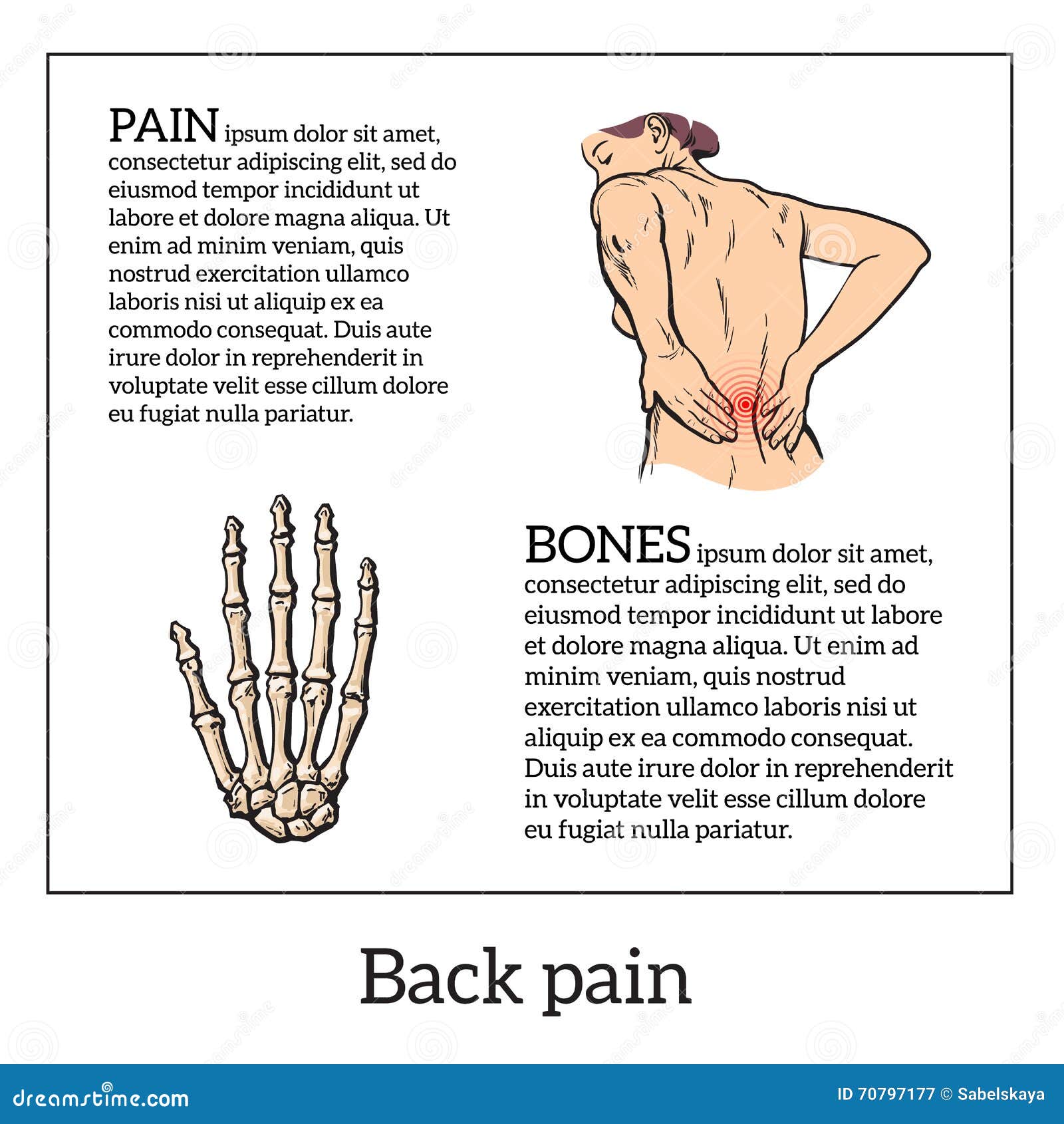 Lage Rugpijn in Vrouwen, Zwart-witte Schets Vector Illustratie ...