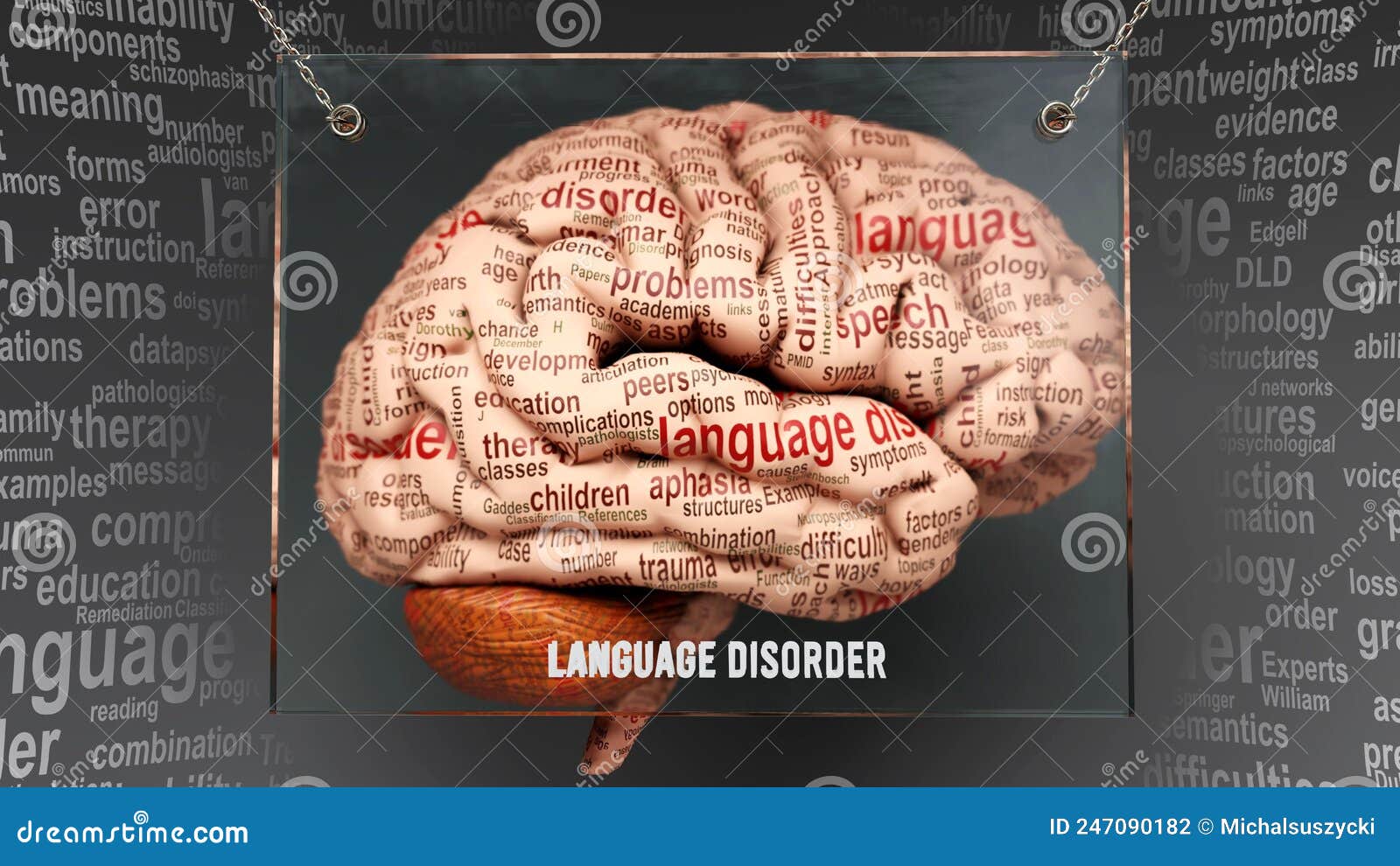 Language Disorder in Human Brain Stock Illustration - Illustration of ...