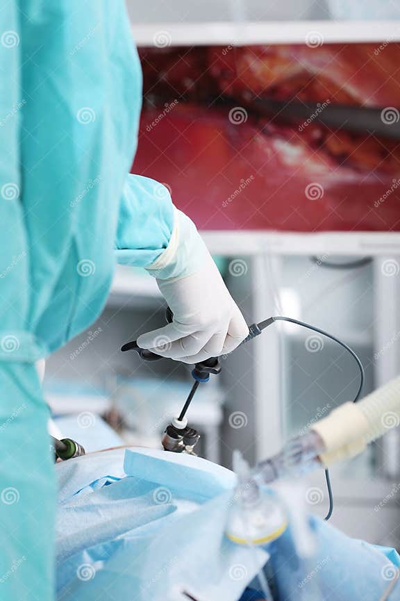Laparoscopic Surgery. Laparoscopic Instruments in the Hands of a ...