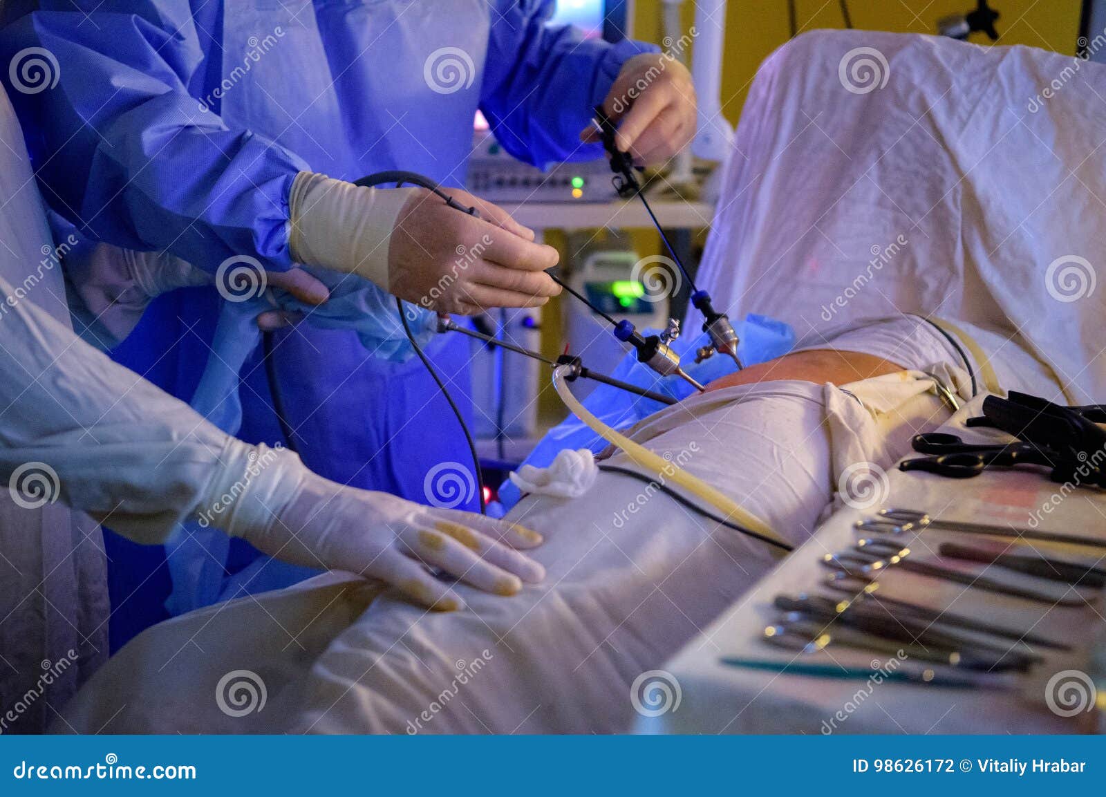 Laparoscopic Surgery Operation Stock Photo - Image of healthcare ...