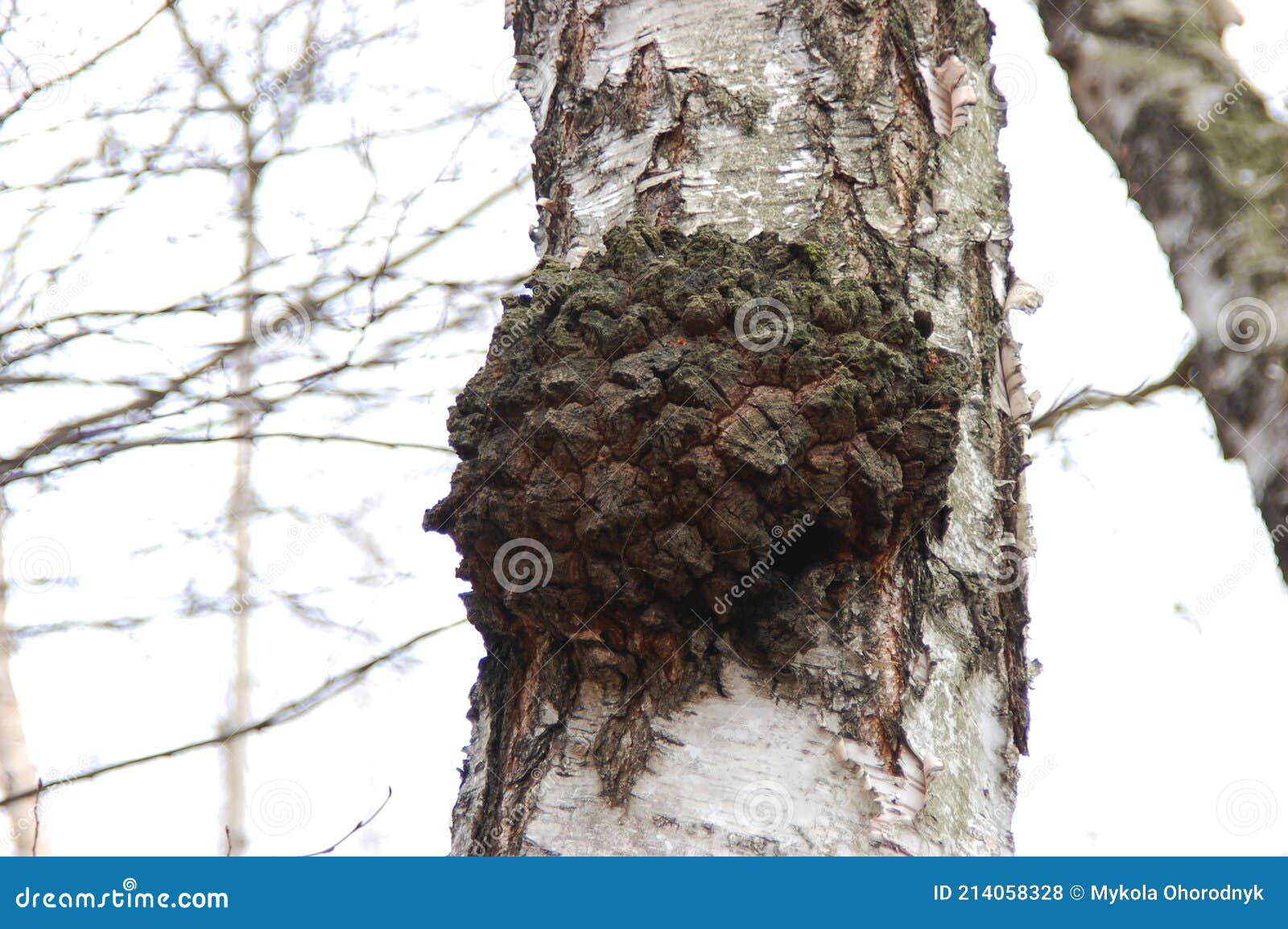 A Large Burr or Burl on the Trunk of a Birch in the Forest Stock Photo ...