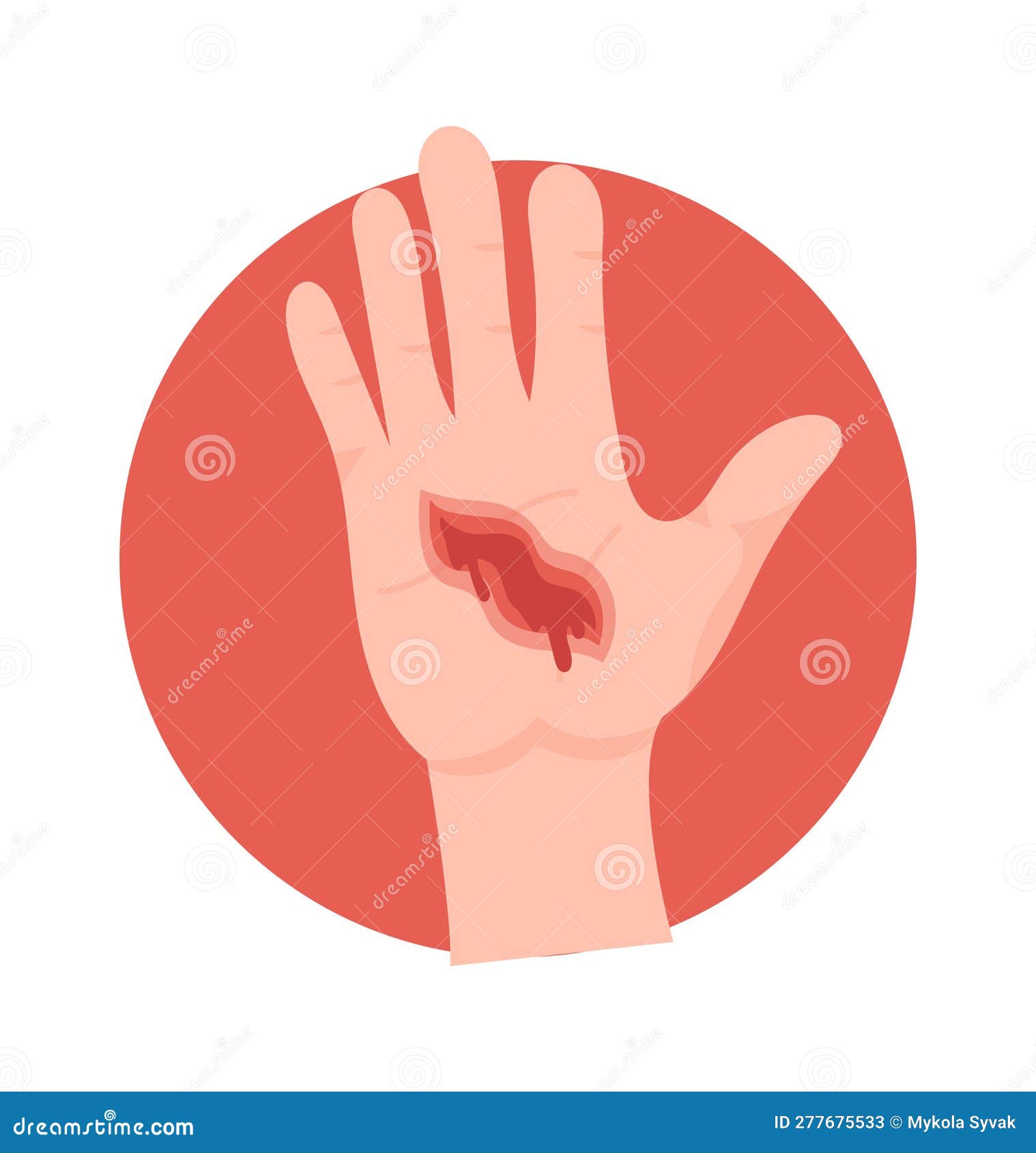 Large and Deep Hand Wound stock vector. Illustration of texture - 277675533