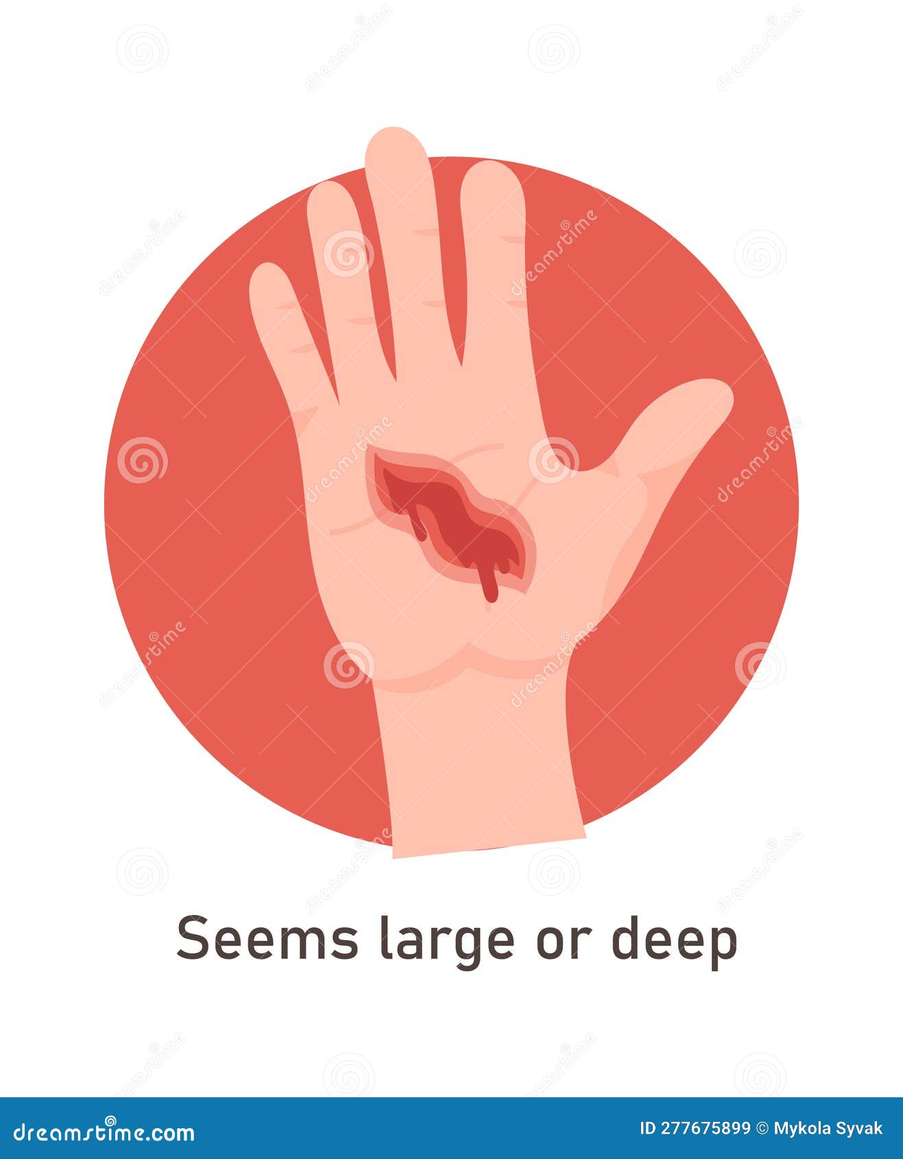 Large and Deep Hand Wound stock vector. Illustration of texture - 277675899