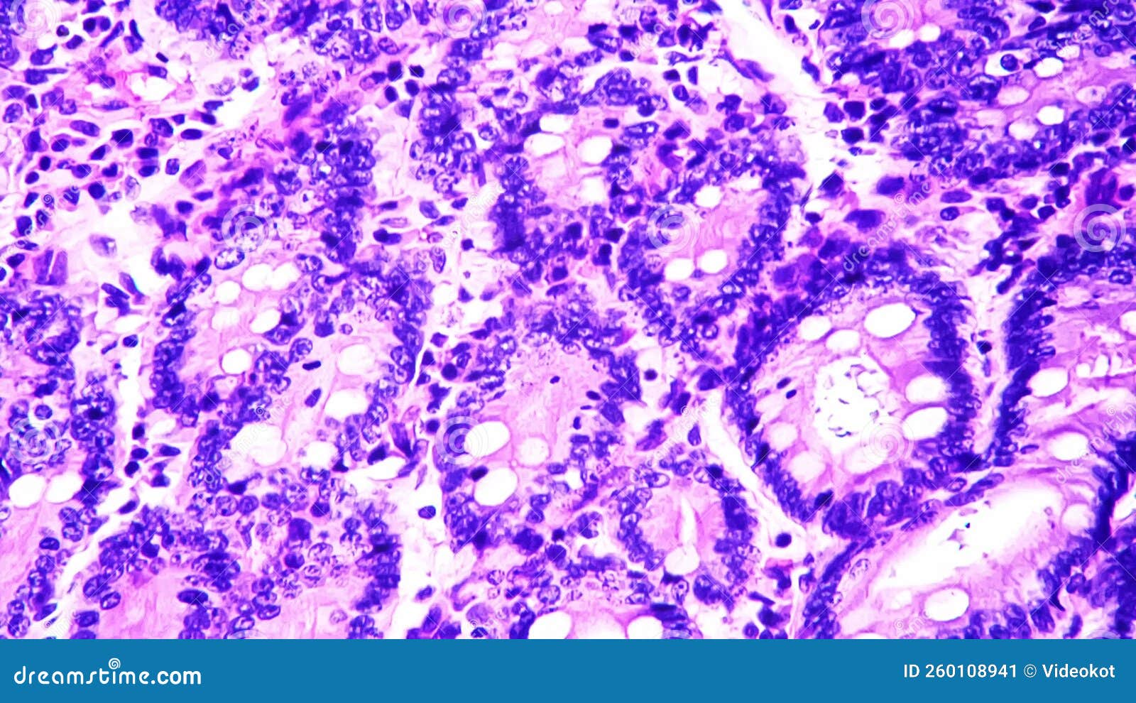 Large Intestinal in Transversal Section Filmed Under Microscope 400x ...