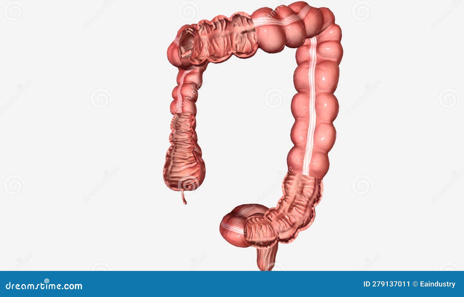 Intestine With Cross Checkmark Grey Icon. Diseased Organ Symbol Vector ...