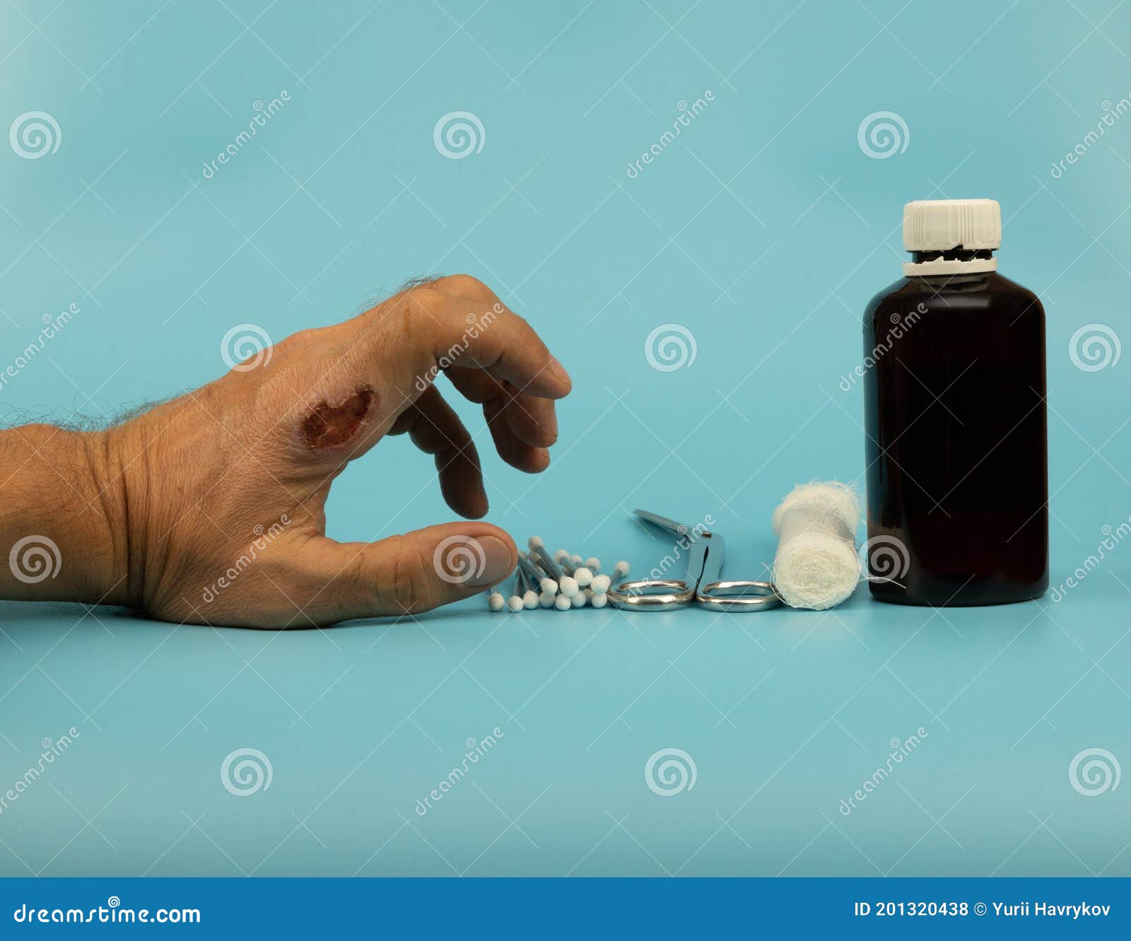 Large Open Wound on the Index Finger of a Man, Side View, Preparation ...
