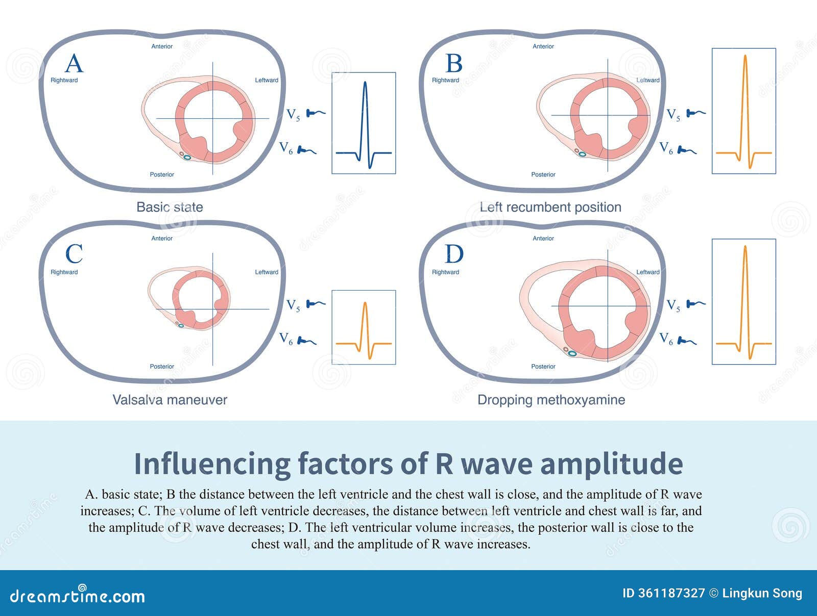 Atrial Wall Of A Human Heart In The Microscope Royalty-Free Stock Photo ...