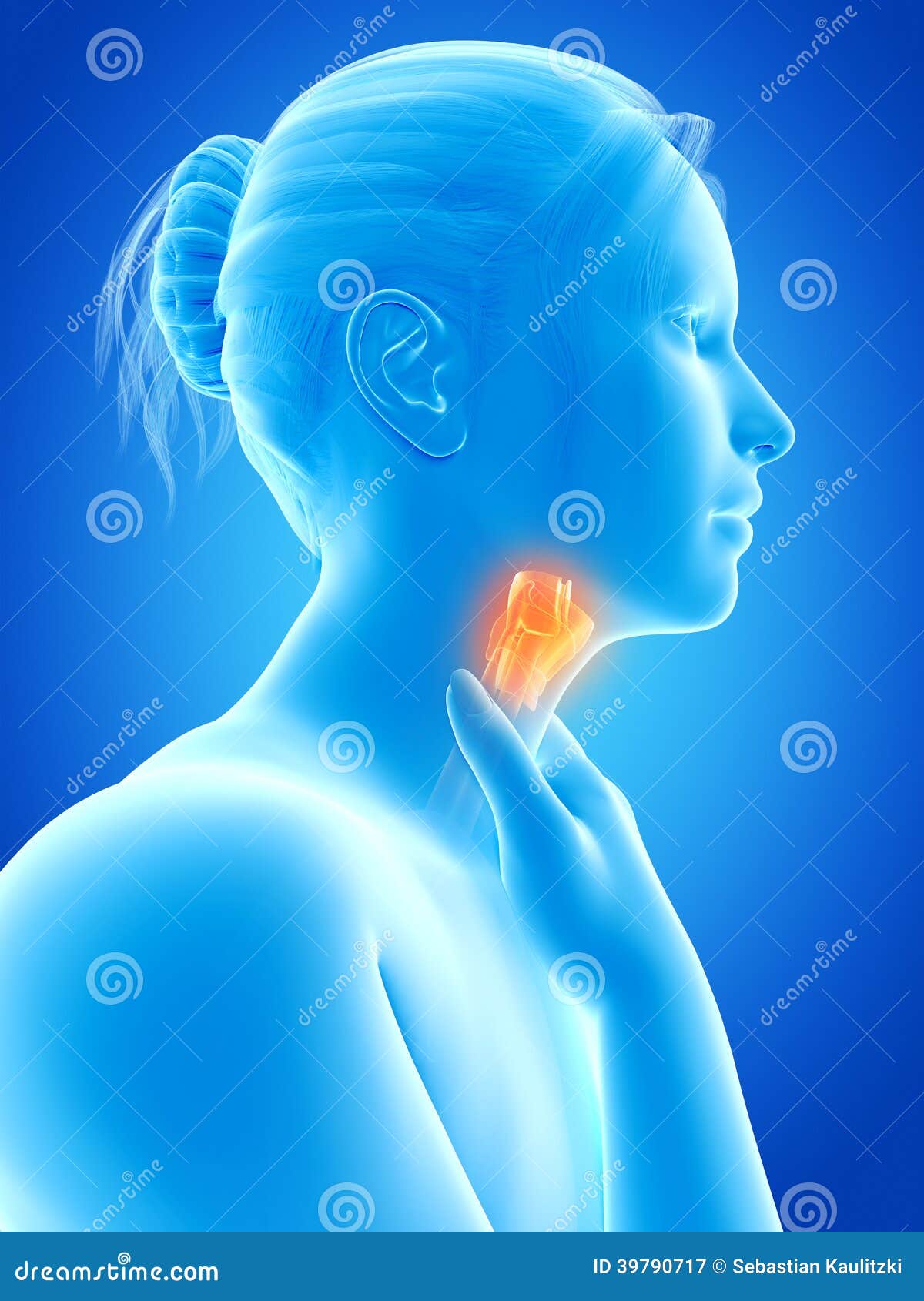 Laringe infiammata illustrazione di stock. Illustrazione di laringite ...