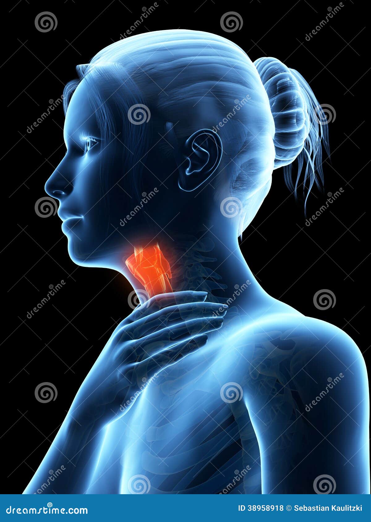 Laringe inflamada ilustração stock. Ilustração de ciência - 38958918