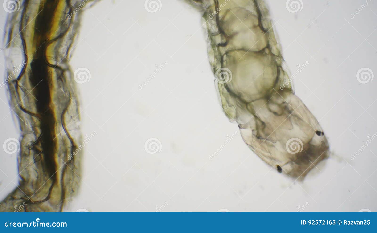 Larvae of Chironomids or Non-biting Midges through a Microscope Stock ...