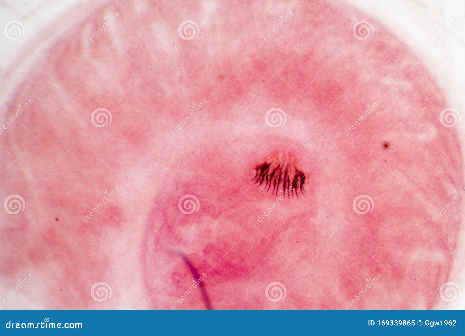 Cysticercus stock image. Image of stained, parasite - 169339865