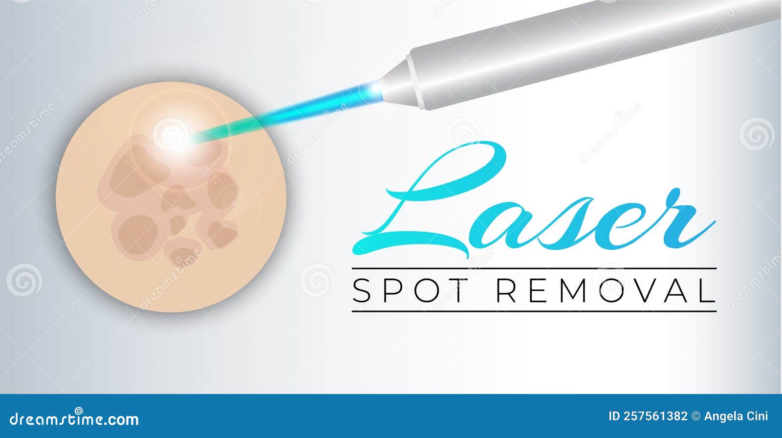Laser Spot Removal Background Illustration Stock Vector - Illustration ...