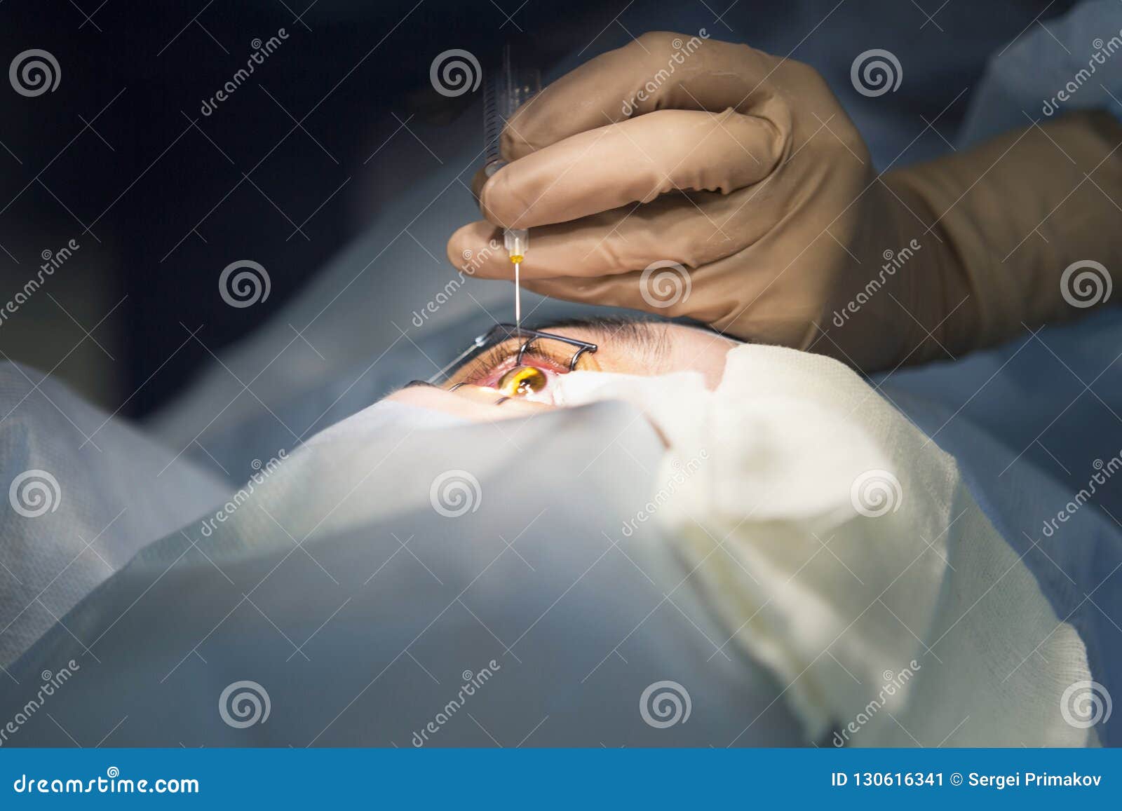 Laser Surgery for Vision Correction Stock Image - Image of operating ...