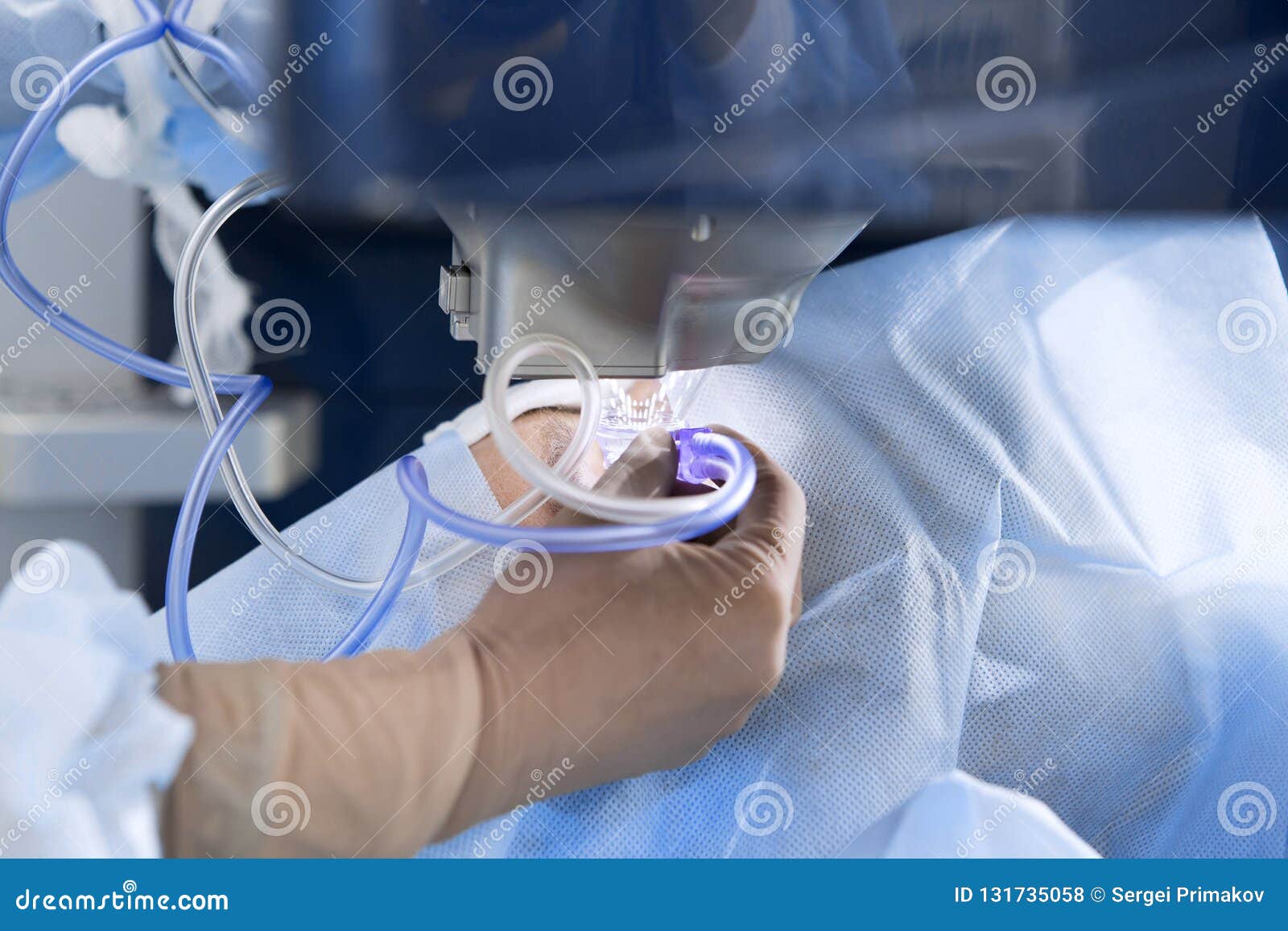 Laser Surgery for Vision Correction Stock Photo - Image of laser ...