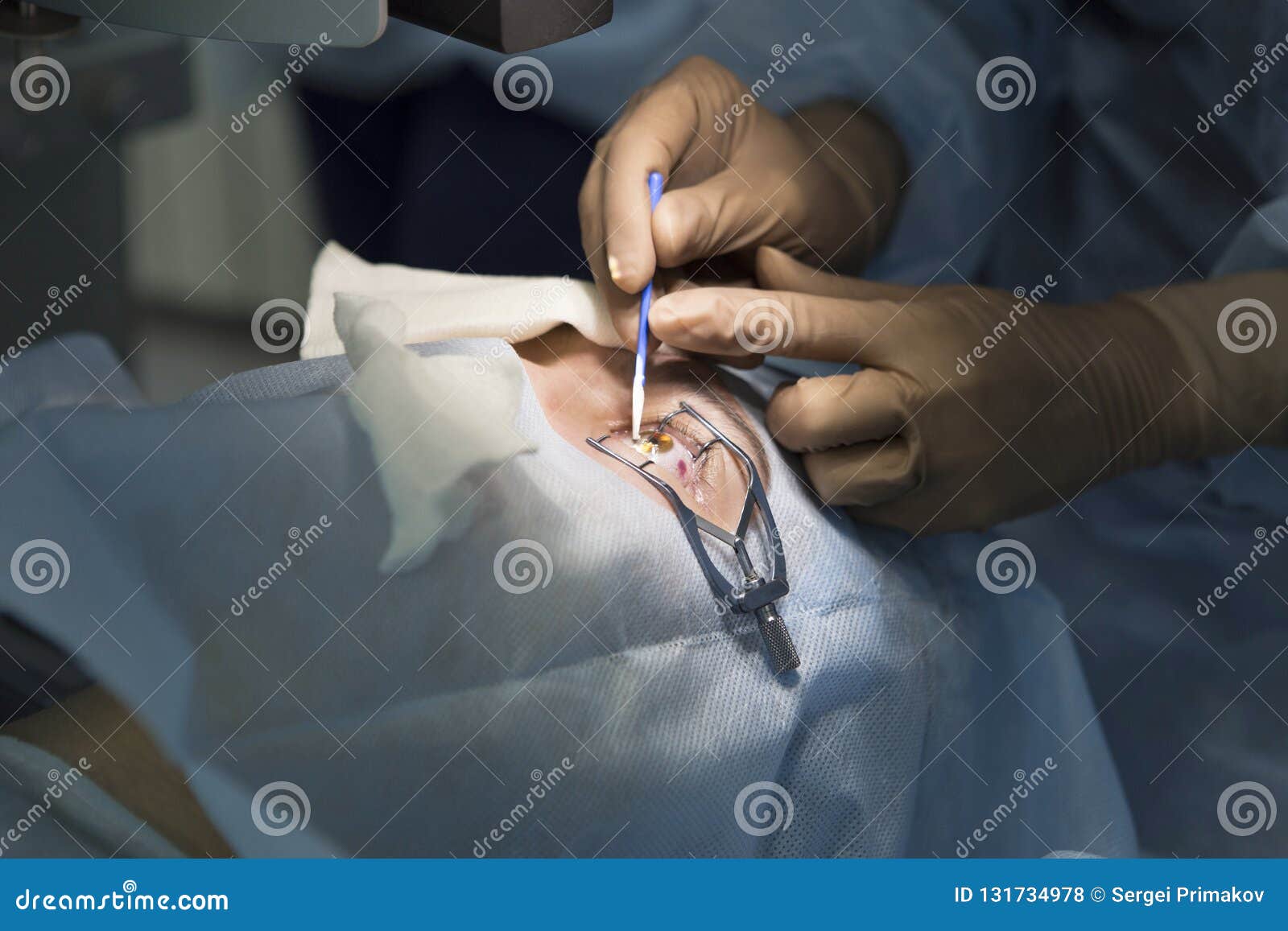 Laser Surgery for Vision Correction Stock Photo - Image of ...