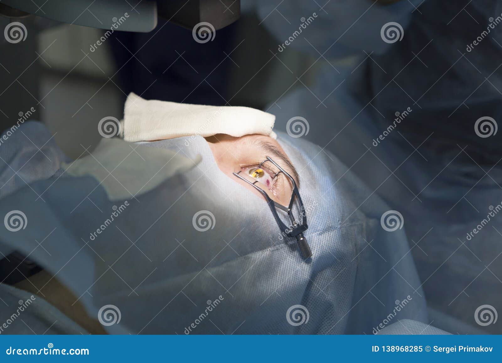 Laser Surgery for Vision Correction Stock Image - Image of optical ...