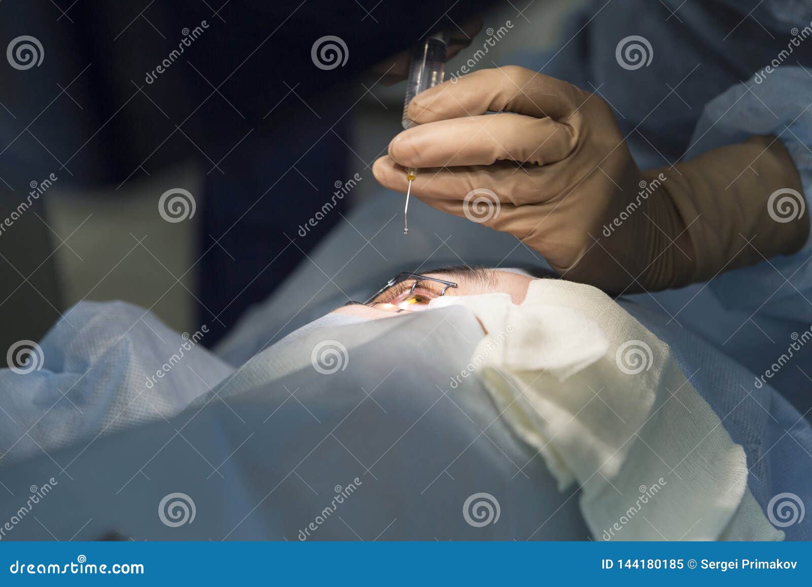 Laser Surgery for Vision Correction Stock Image - Image of glaucoma ...