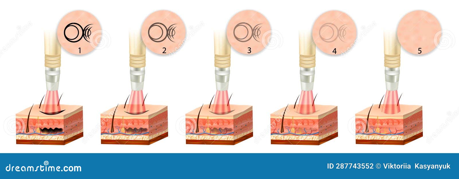 Absorb Light Absorption Royalty-Free Illustration | CartoonDealer.com ...