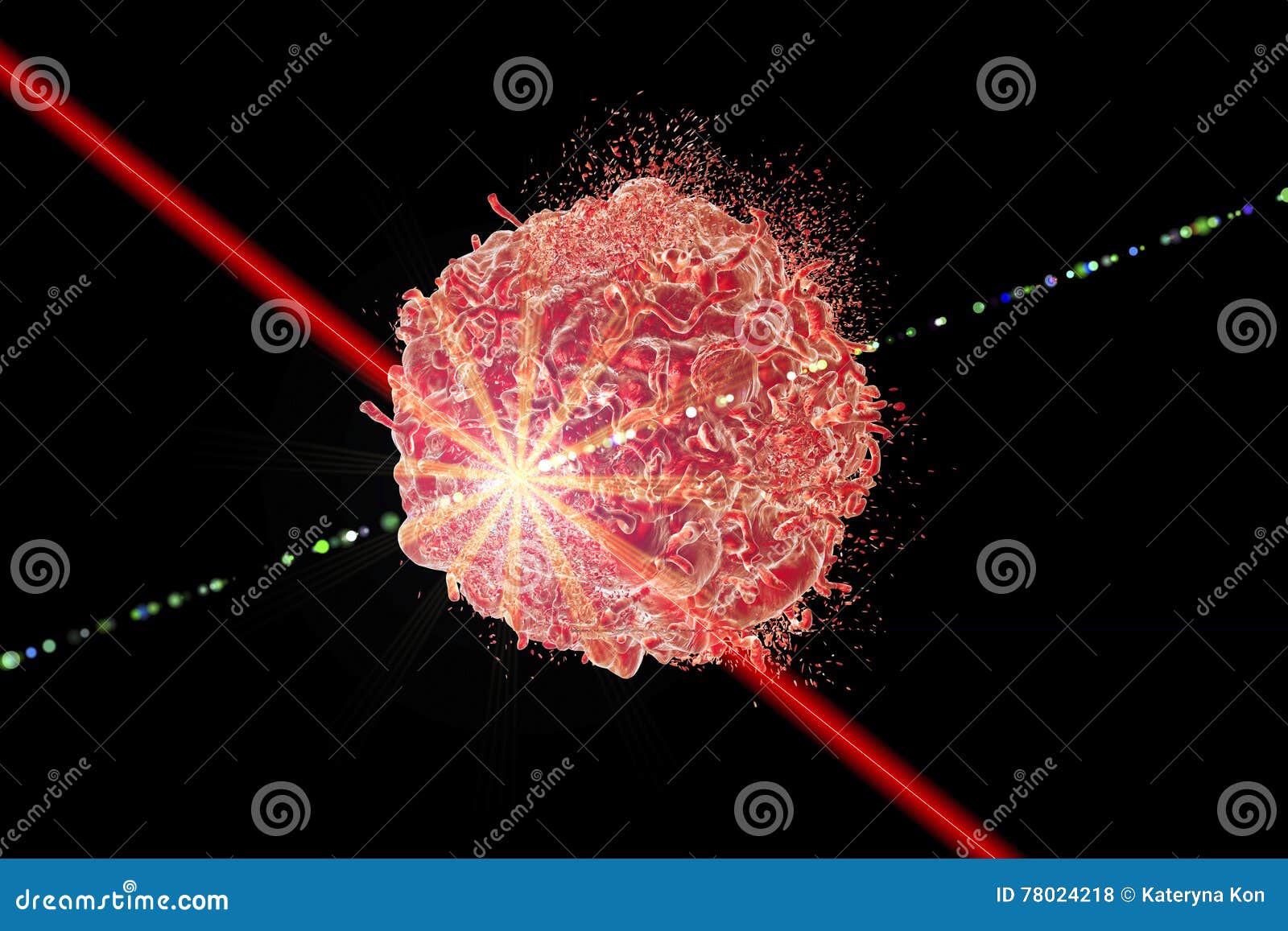 Laser Therapy of Cancer Concept Stock Illustration - Illustration of ...