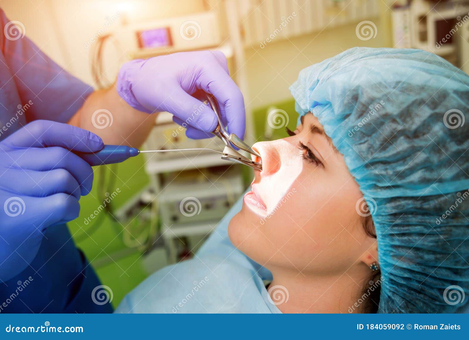 Laser Vaporization of Nasal Concha with Coblation Technology Method ...