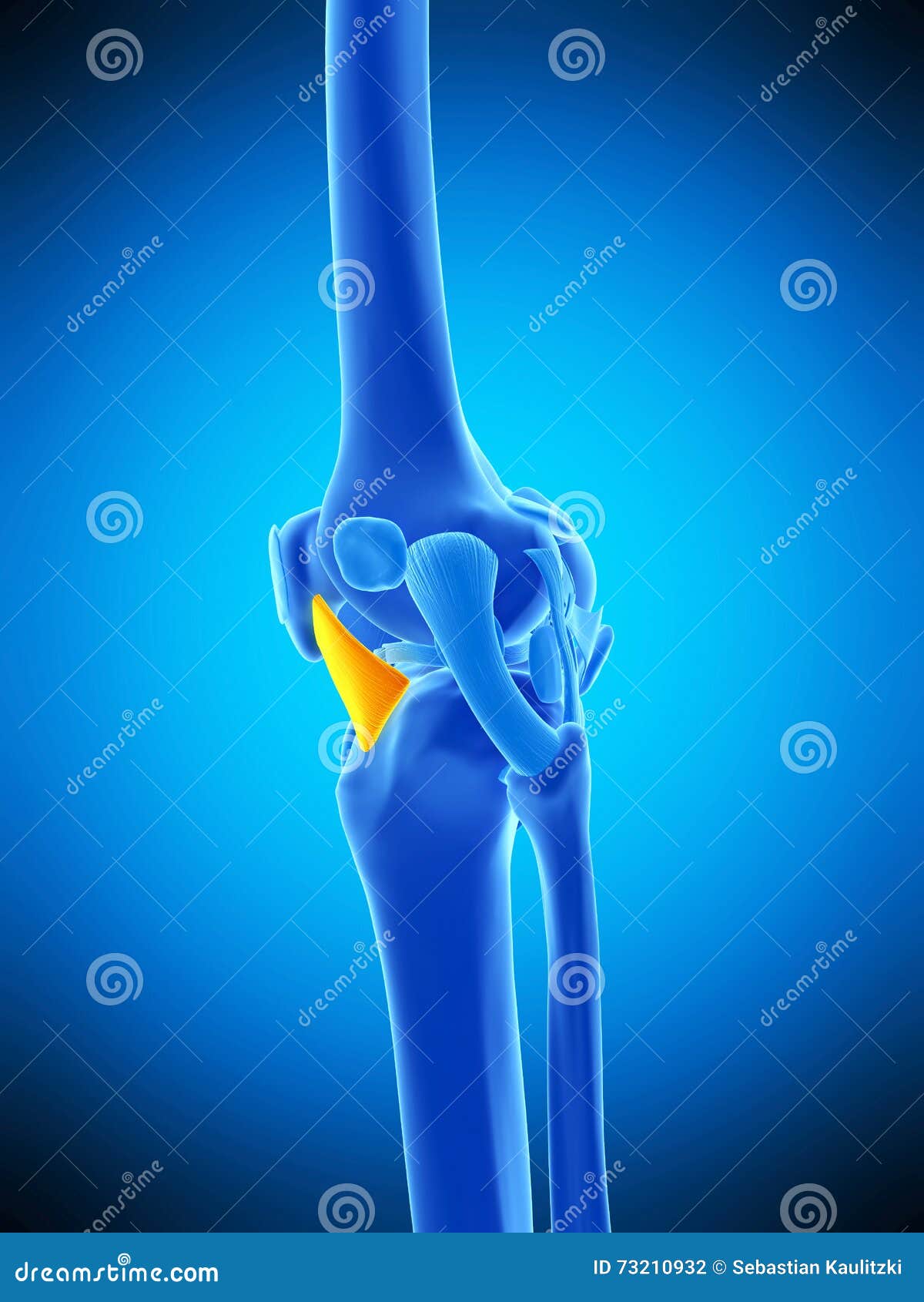 Anatomy_Patellar Tendon Rupture Vector Illustration | CartoonDealer.com ...
