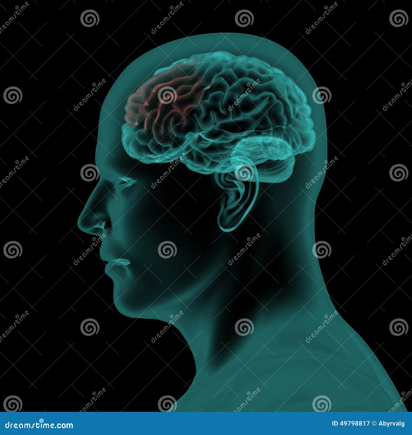 Lateral X-ray Scan View of Human Head and Brain Stock Illustration ...